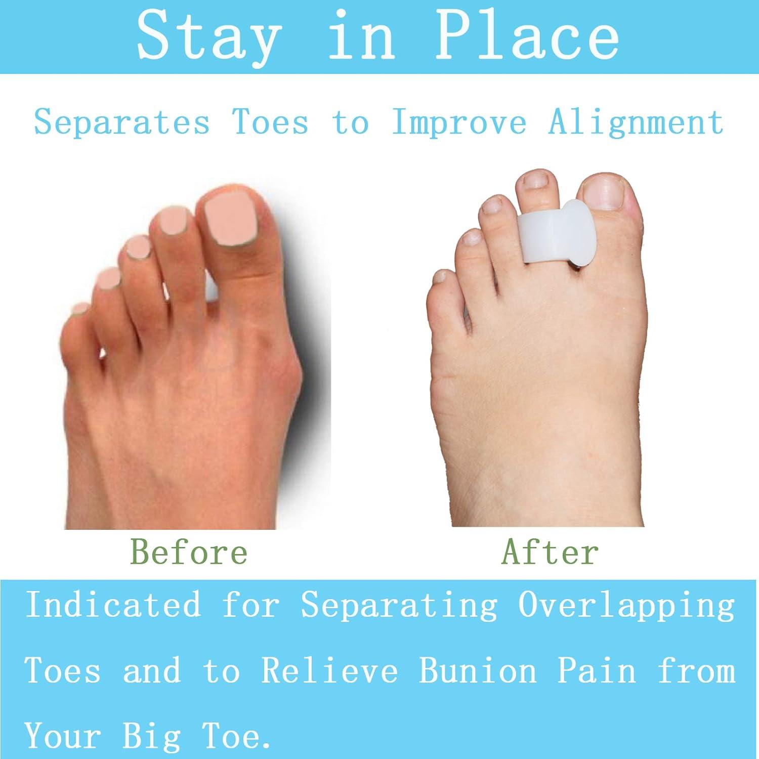 Menocady Pack of 12 Toe Separator Gel Toe Spacers for Bunions - Big Toe ...