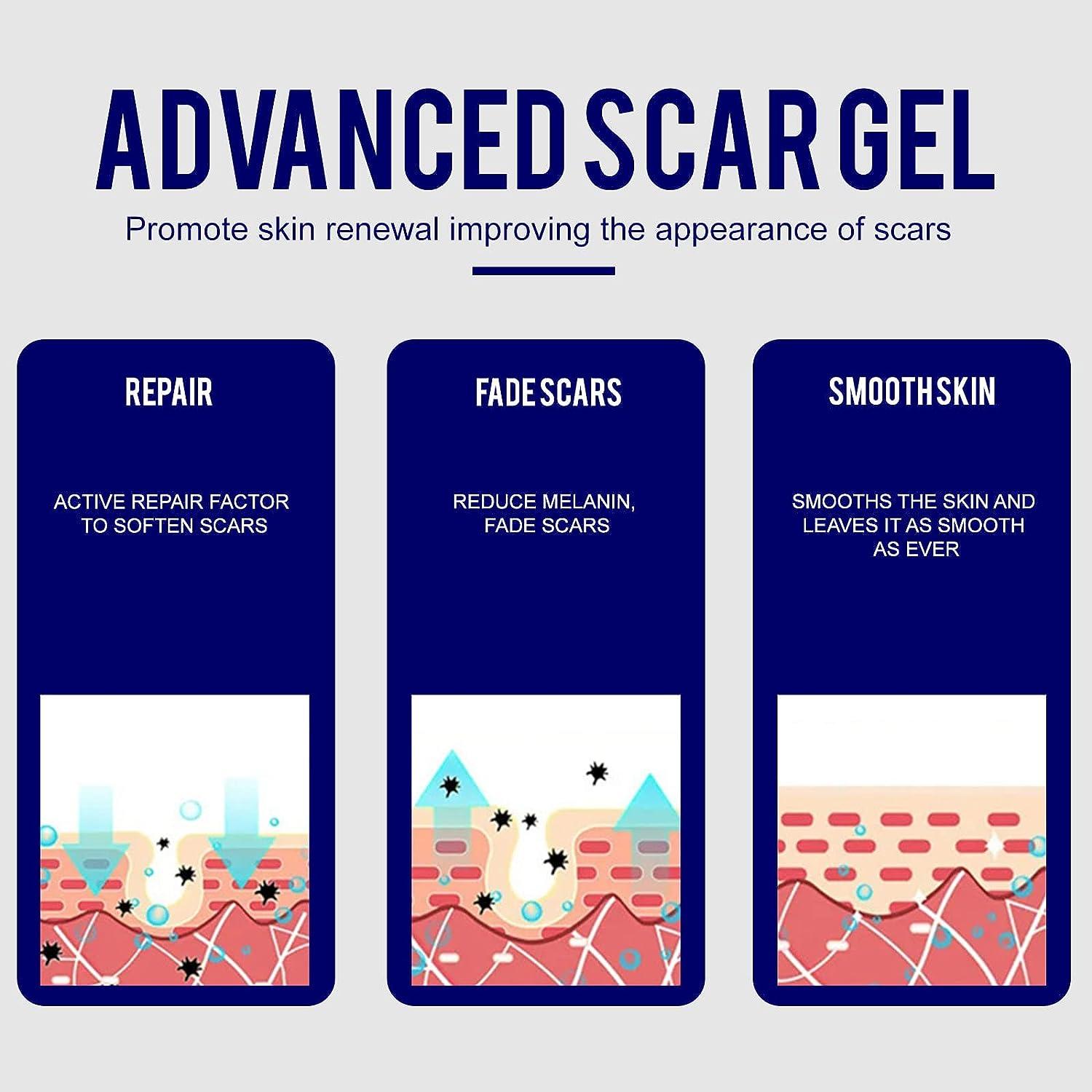Scar Cream Gel with Retinol, Allantoin & Vitamin E - Advanced Scar ...