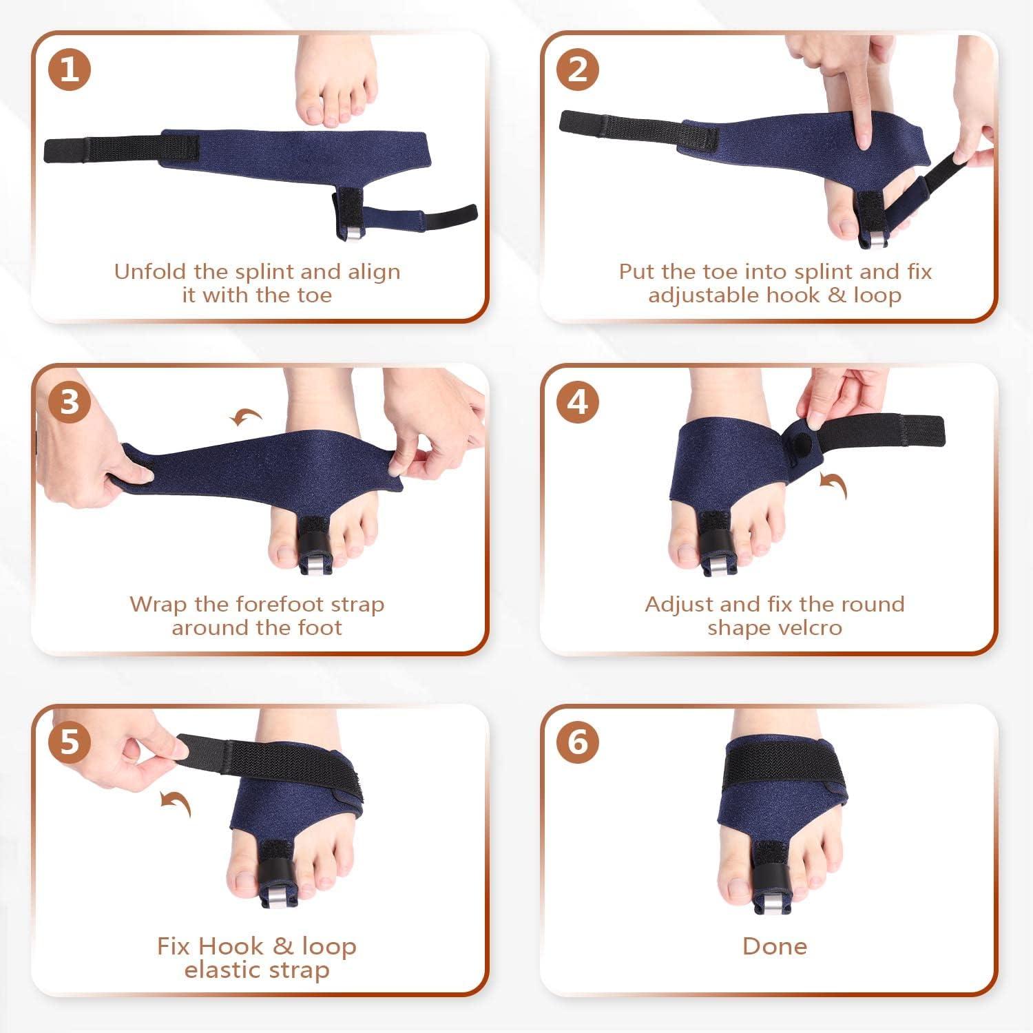 Buy Scurnhau Toe Rail - Ultimate Toe Protection & Hammer Toe Correctors ...