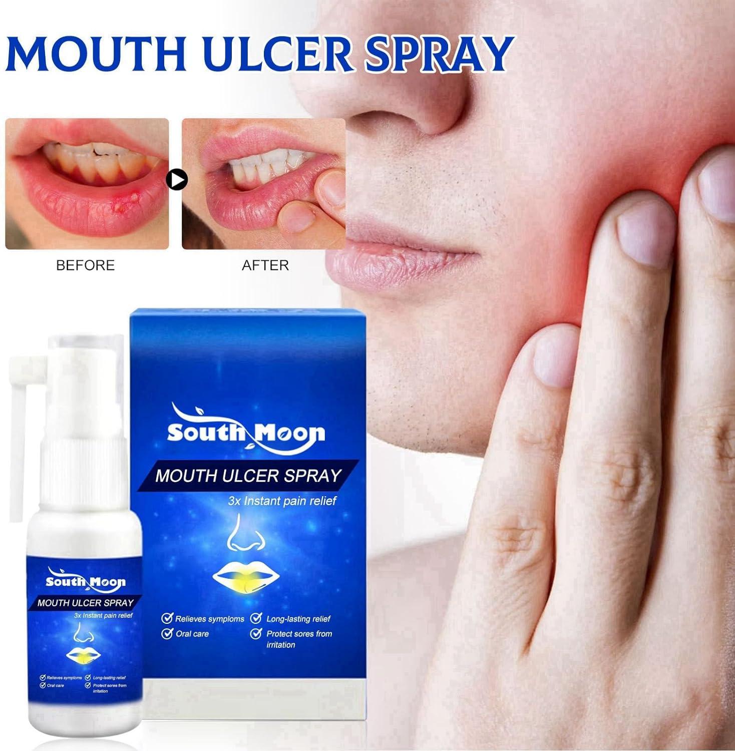 Mouth Ulcer Treatment Spray Oral Ulcer Sprays Ulcer Breath Sprays ...