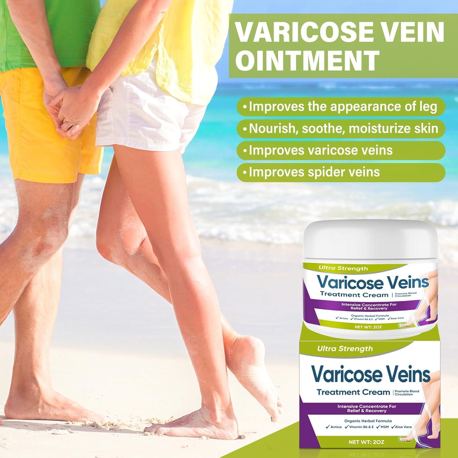 Effective Varicose Veins Treatment Cream | Relieve Leg Swelling ...