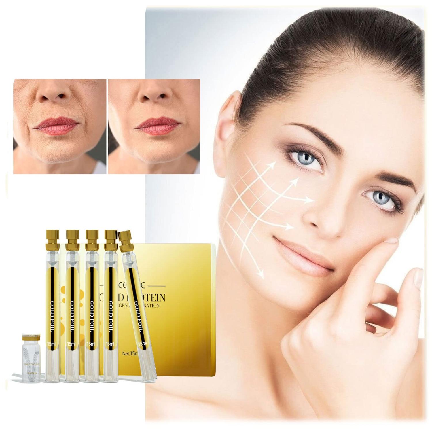 Instalift Protein Thread Lifting Set Skin Care Absorbable Collagen ...