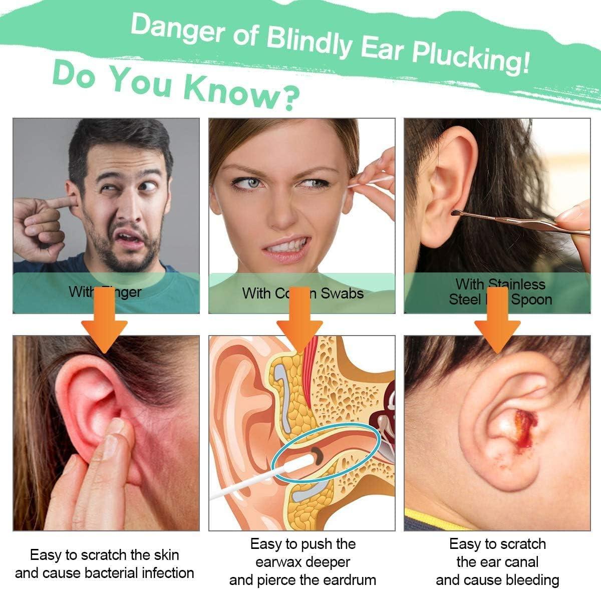 Softula Wireless Otoscope Earwax Removal Tool - 1080P HD WiFi Endoscope ...