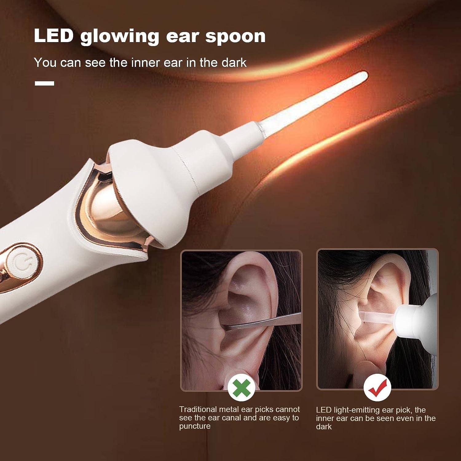LED Ear Wax Removal Kit with Safe & Soft Tools - White | Earwax Remover ...