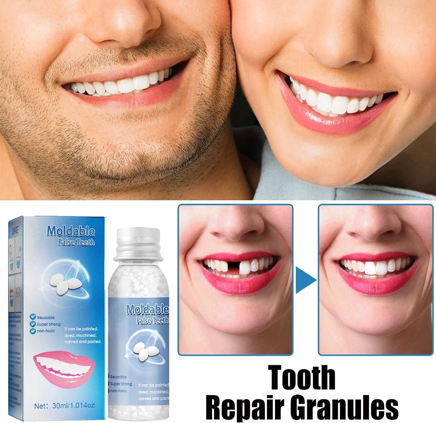 Xirujnfd Tooth Repair Granules - Cavity Filler Kit for Chipped Teeth ...