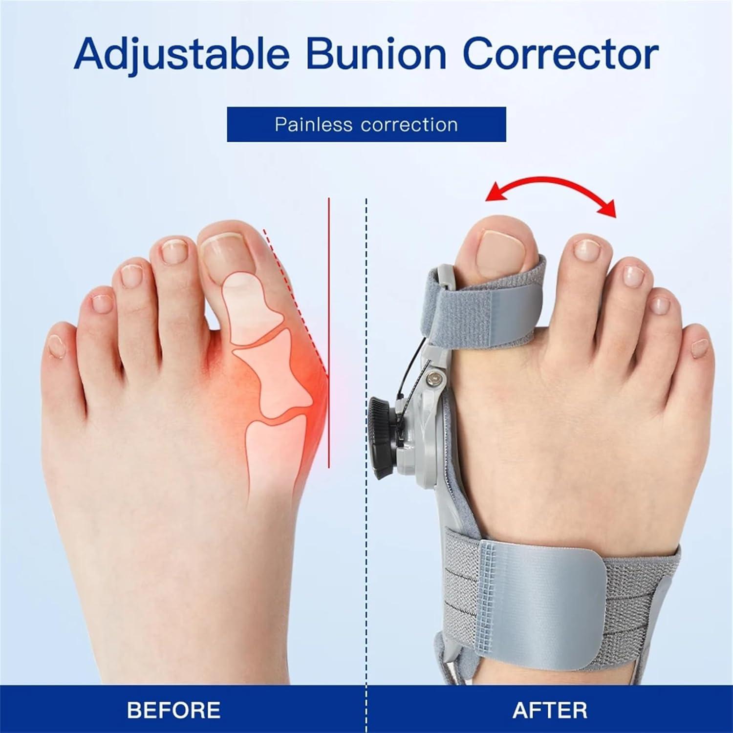 Zeetan Adjustable 2-Piece Toe Corrector - Relief for Bunions ...