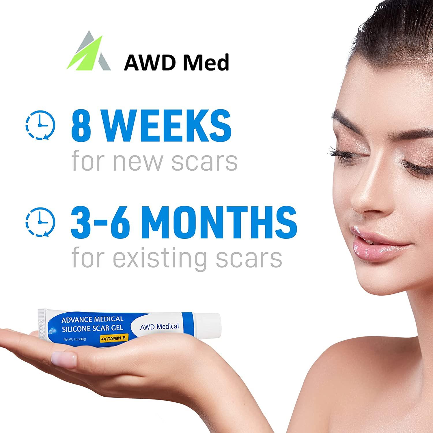 AWD Medical Silicone Gel - Scar Removal and Skin Care Cream with ...