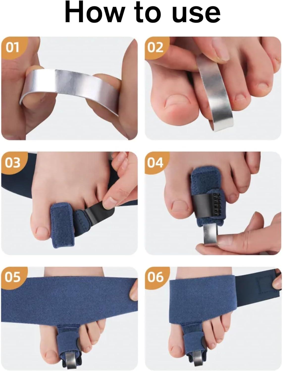 Sovio U Shaped Toe Straightener for Bent Toes + Hammer Toe Support (1PC ...