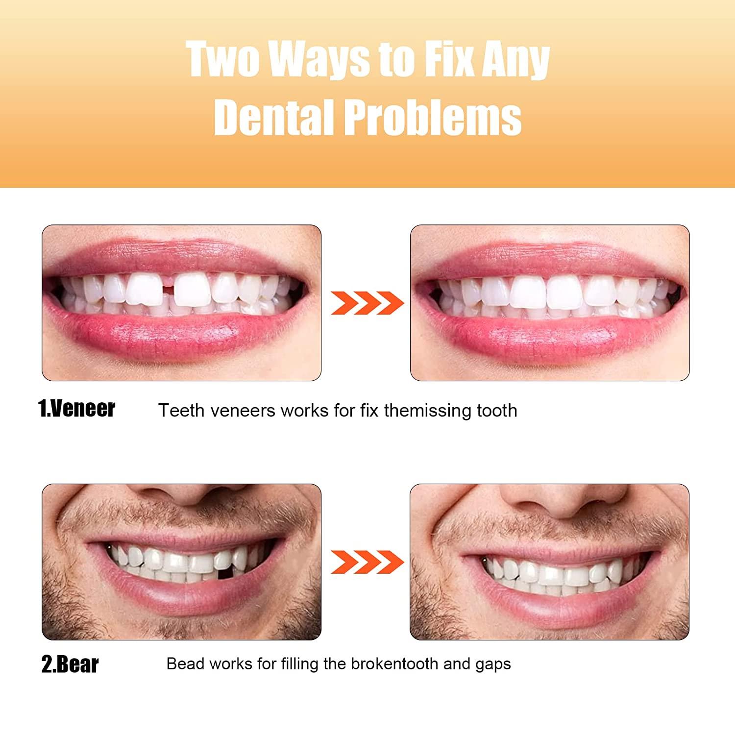 Temporary Tooth Repair Kit - Natural Shade Fake Teeth Filling for ...
