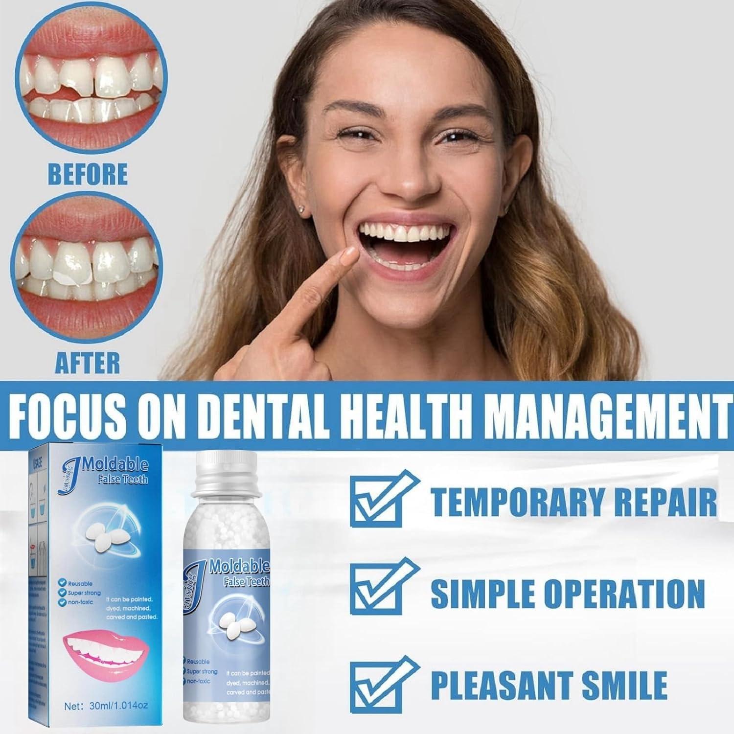 Diy Moldable False Teeth Repair Kit Instant Tooth Filling Replacement Dental Repair Tools