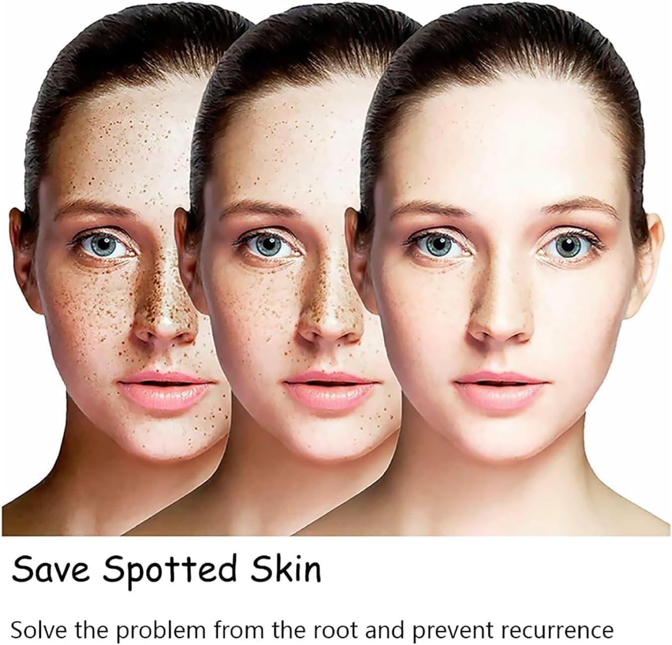 Aobenz Serum Aobenz Whitening and Freckle Removing Essence Aobenz Anti ...