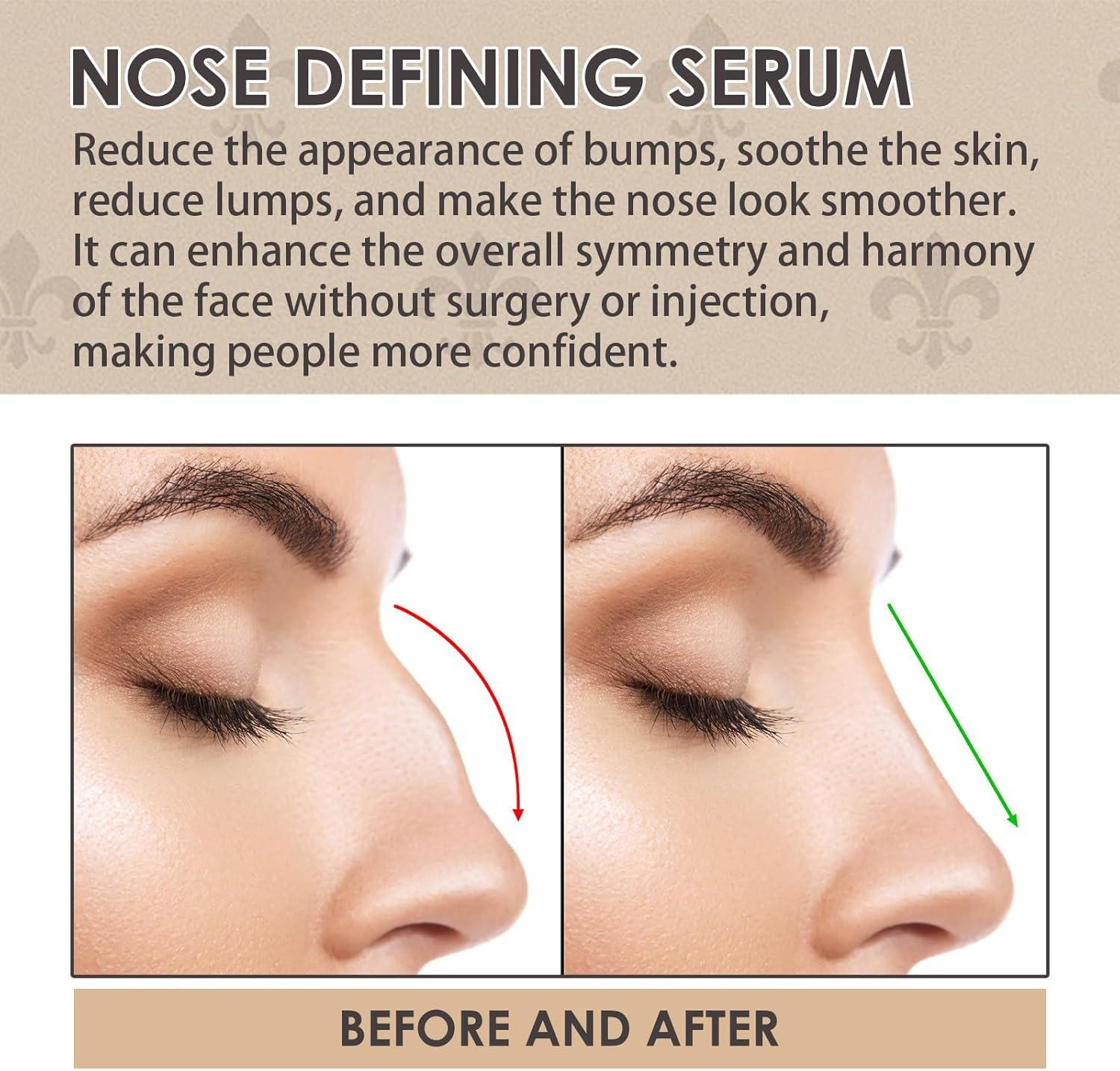 Orgrul Rhinoplasty serum Z Nose Defining Serum nasal bone remodeling ...