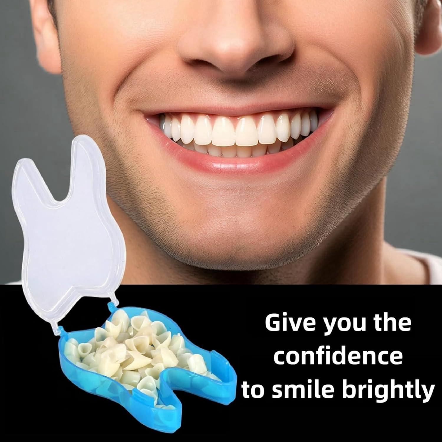 70PCS Temporary Tooth Repair Kit | False Tooth Replacement & Crowns ...