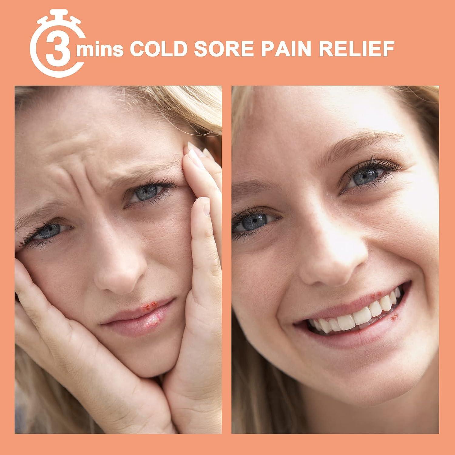 PEEWF Cold Sore Treatment Device - Red & Blue Light Therapy for Fast ...