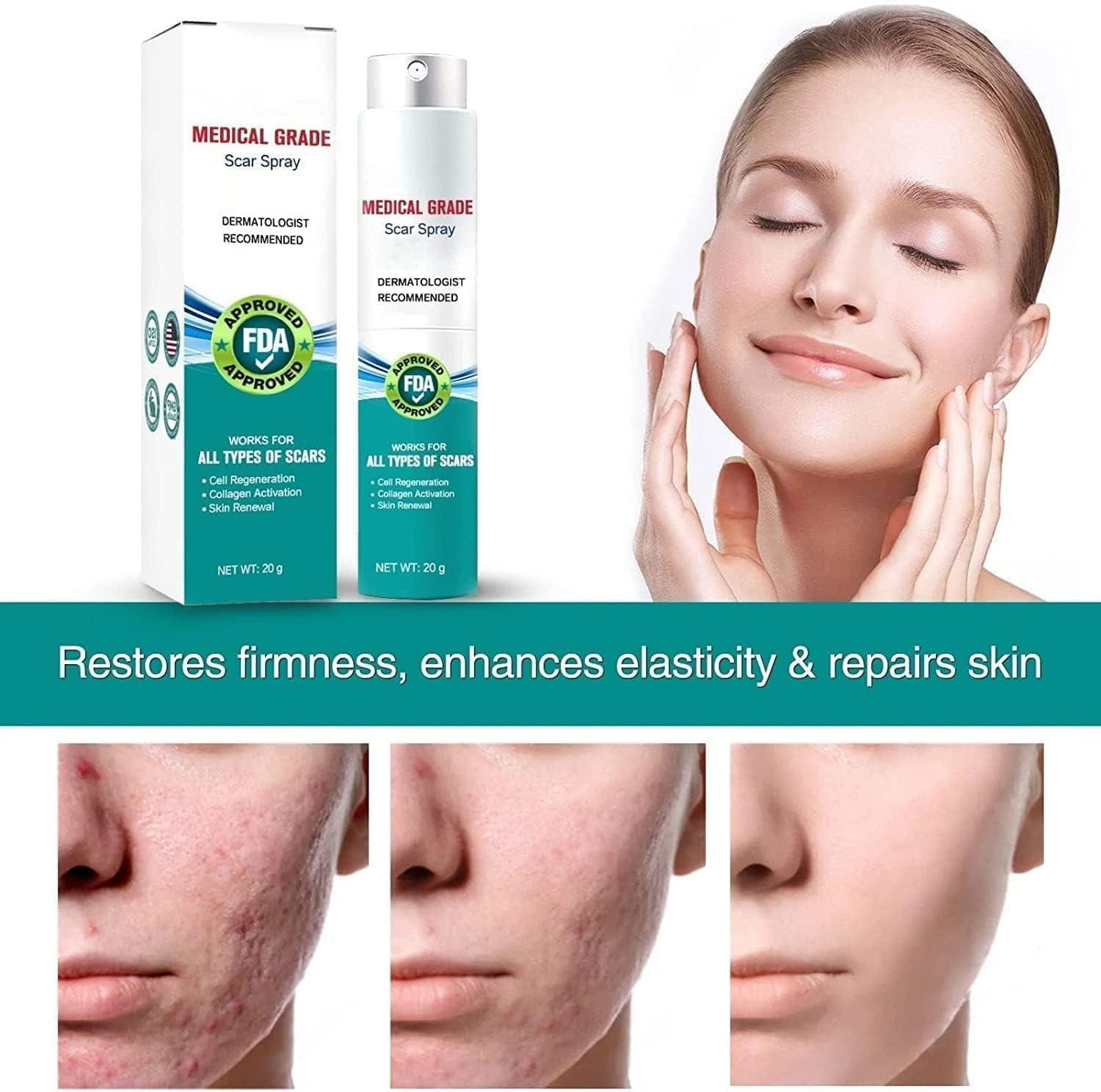 Proregen Scar Removal Spray - Advanced Medical Grade Solution for All ...