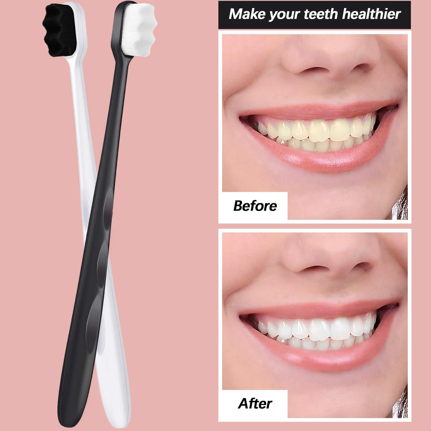 8-Piece Extra Soft Micro-Nano Toothbrush Set for Fragile Gums - Gentle ...