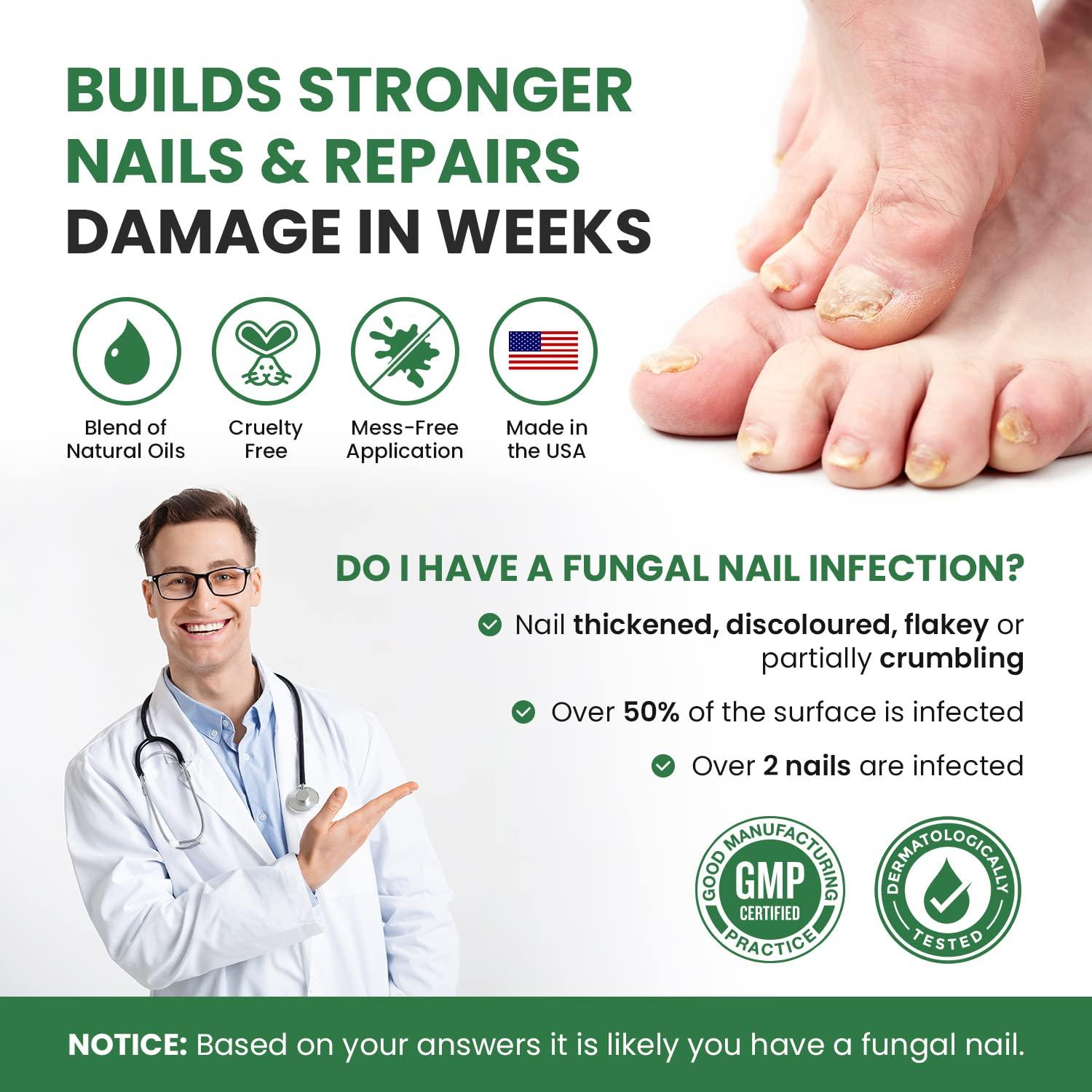 Extra Strength Toenail Fungus Treatment - Nail Repair Solution for ...