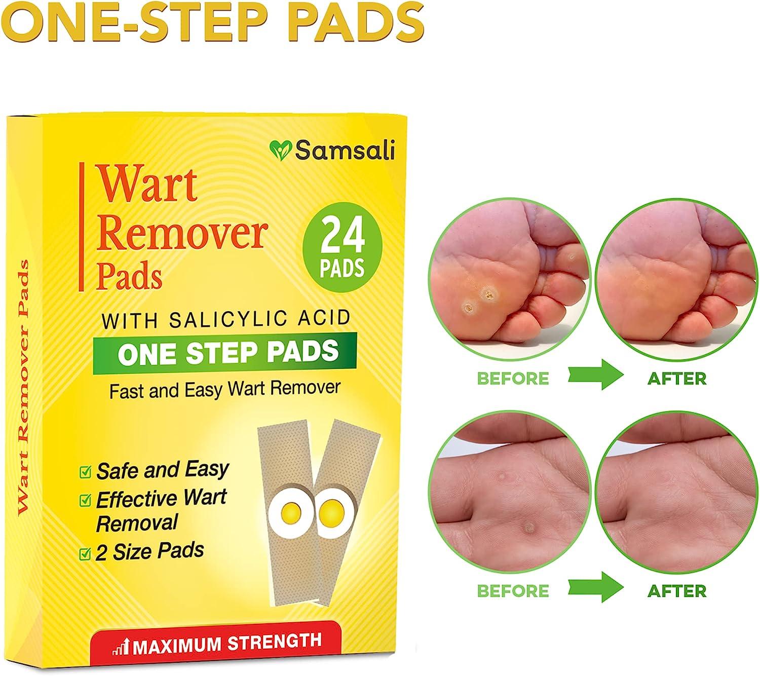 Samsali Highly Potent Wart Remover Treatment - 24 Pads for Finger, Hand ...
