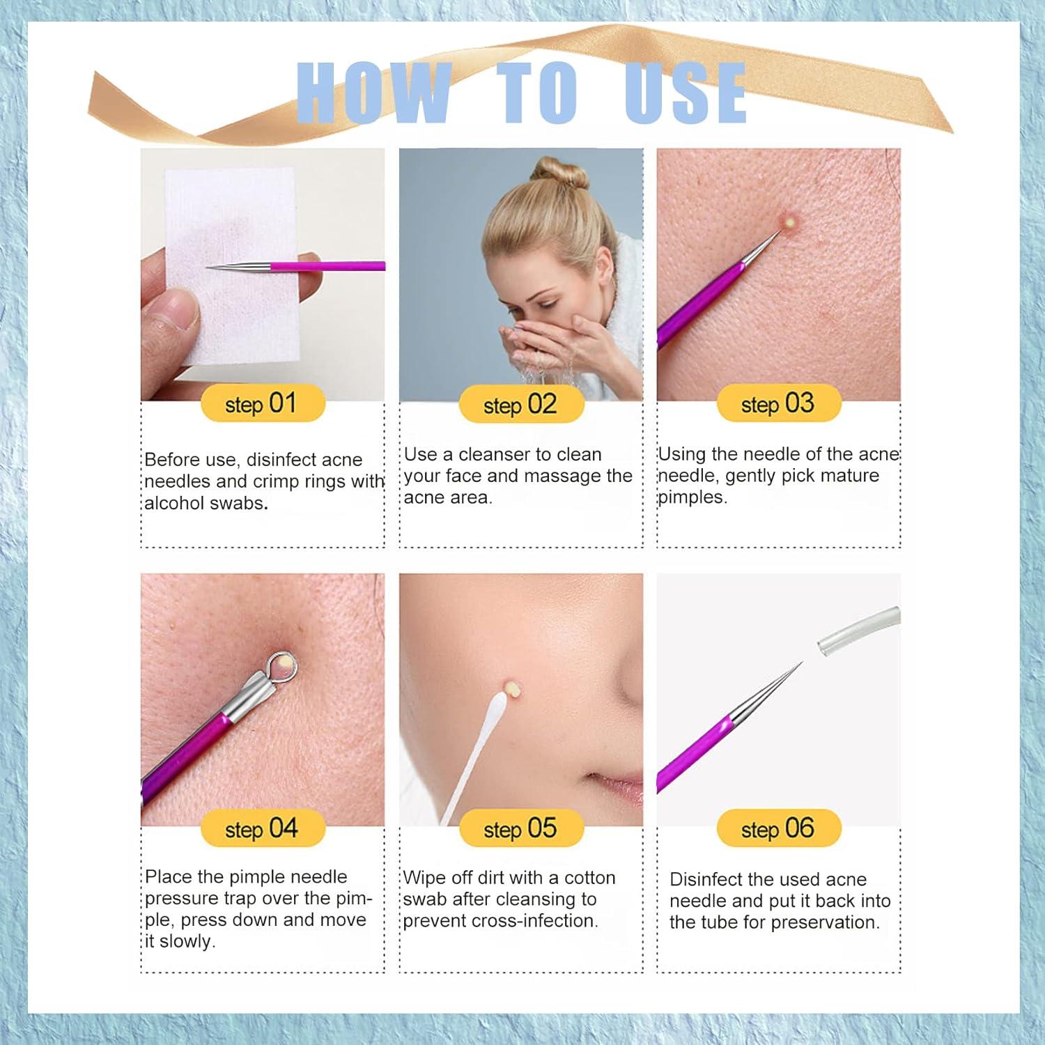 Hearyone Pimple Popper Tool Kit | 7pcs Blackhead & Acne Removal Set ...