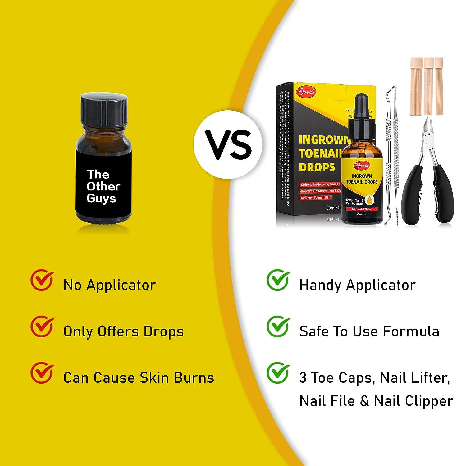 Pjordo Ingrown Toenail Treatment Kit - Includes Drops, Pain Reliever ...