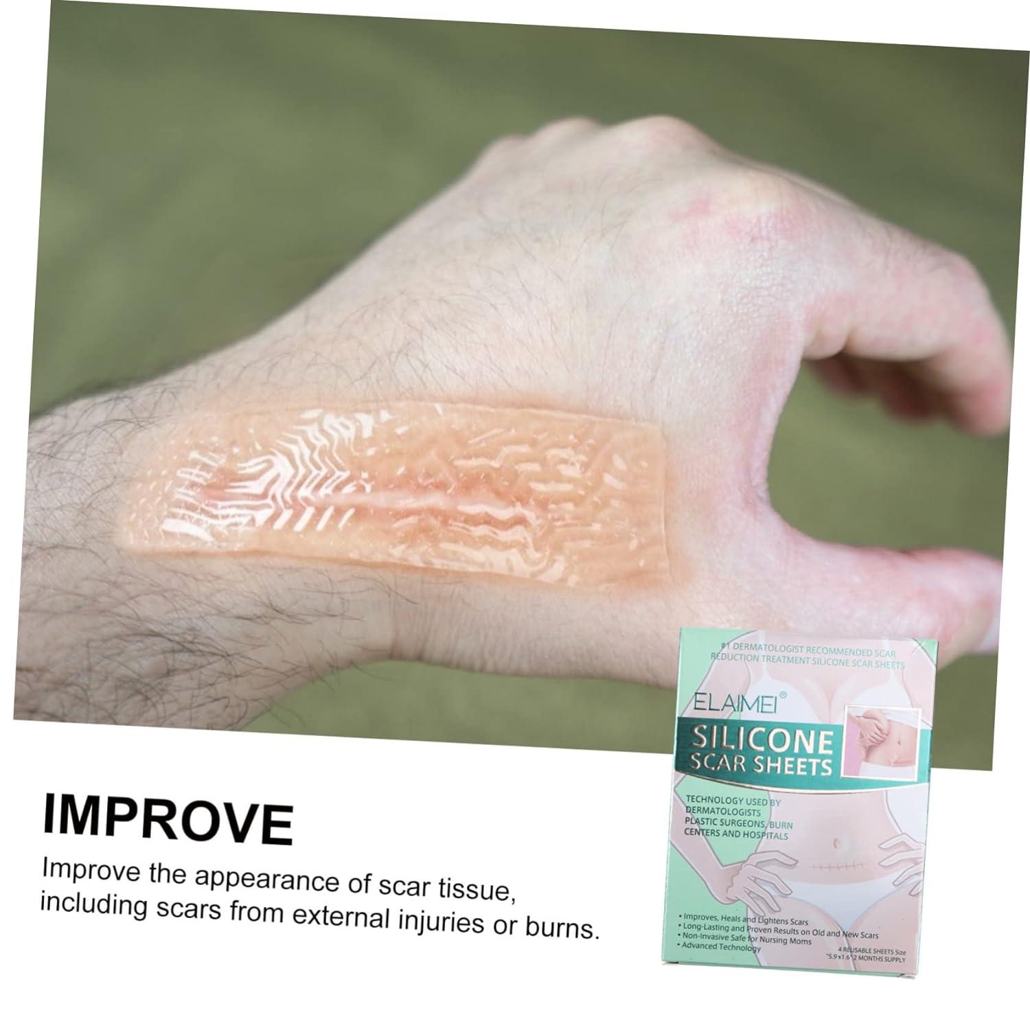 Healeved 4pcs Silicone Scar Sheets - Burn Scar Removal Cream - Scar ...