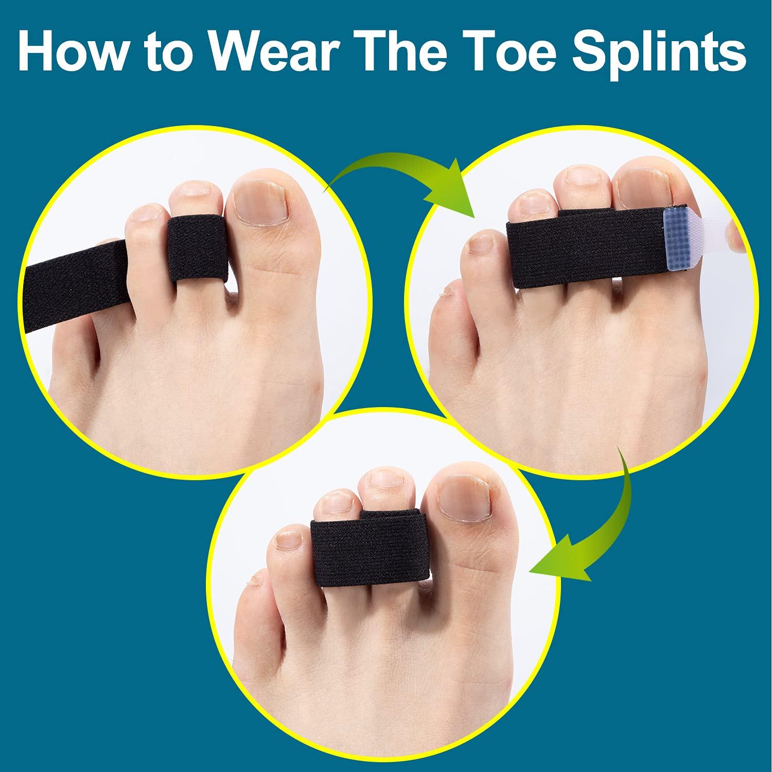 Kimihome Toe Splints - Corrector for Overlapping Toe, Hammer & Crooked ...
