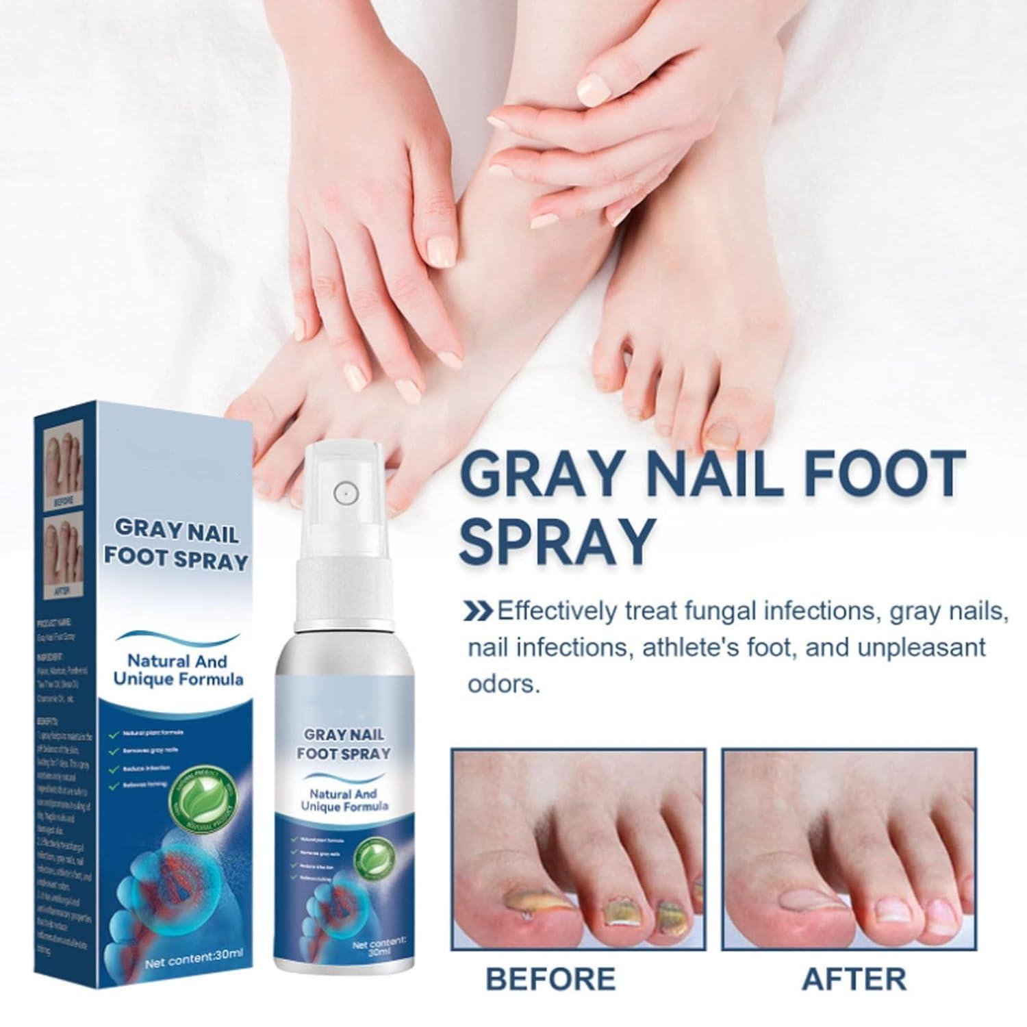 Furzero Nail Fungus & Athlete's Foot Treatment Spray - Medical Grade ...
