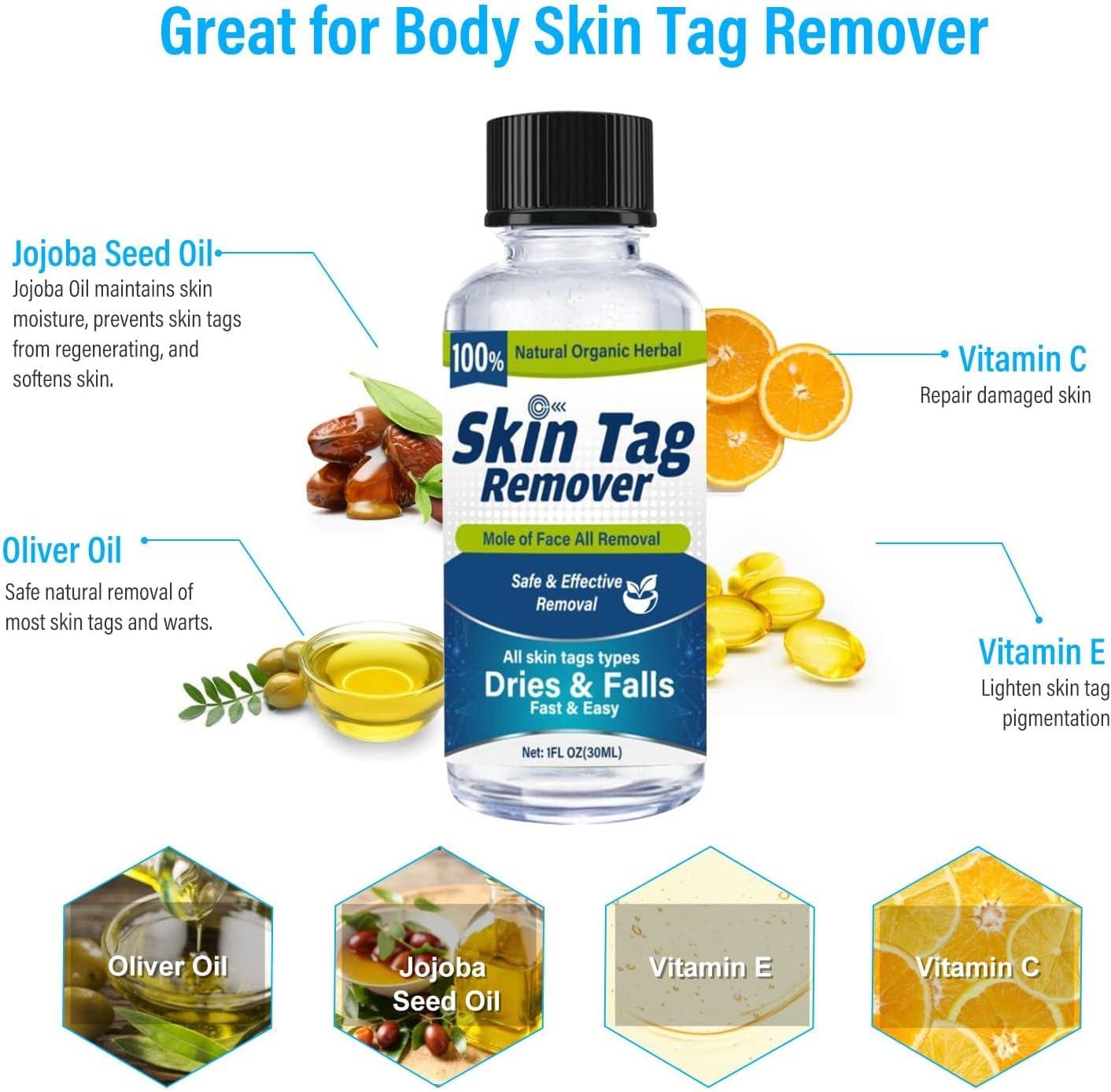 Skin-Tag-Remov-al-Skin-Tag-Remover Wart & Mole-Remover Lotion Fast ...