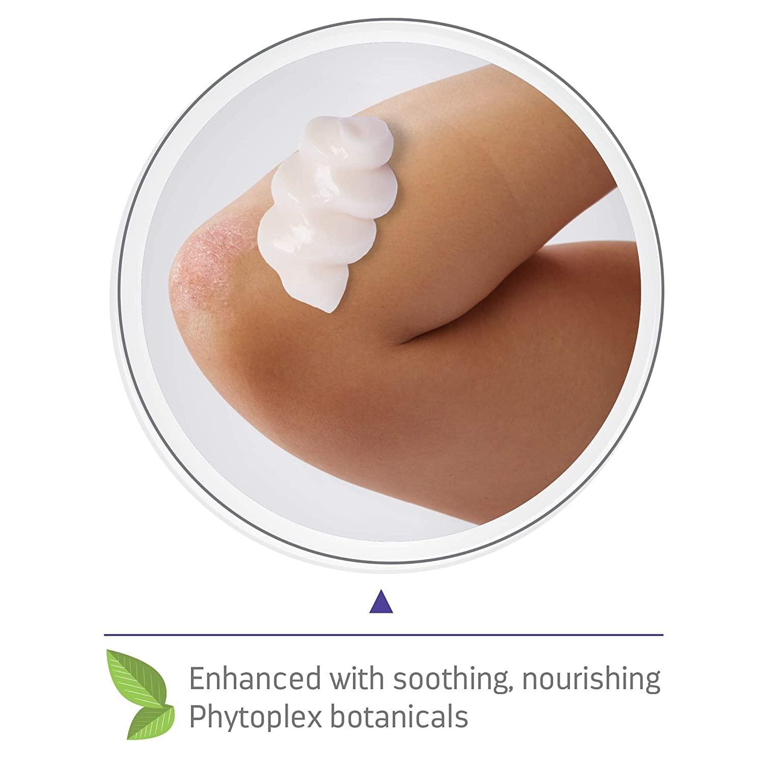 Medline Remedy Intensive Skin Therapy Cream with Phytoplex 2 oz - For ...