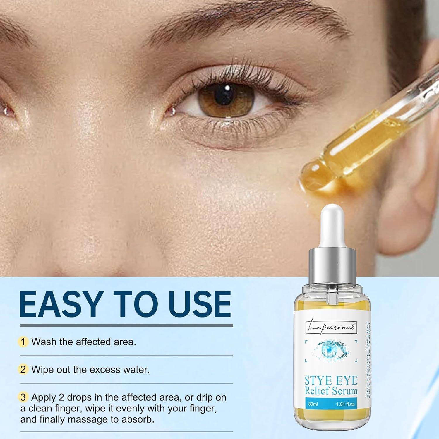 Stye Eye Serum 30ml | Vegan Relief for Styes Chalazion & Blepharitis ...