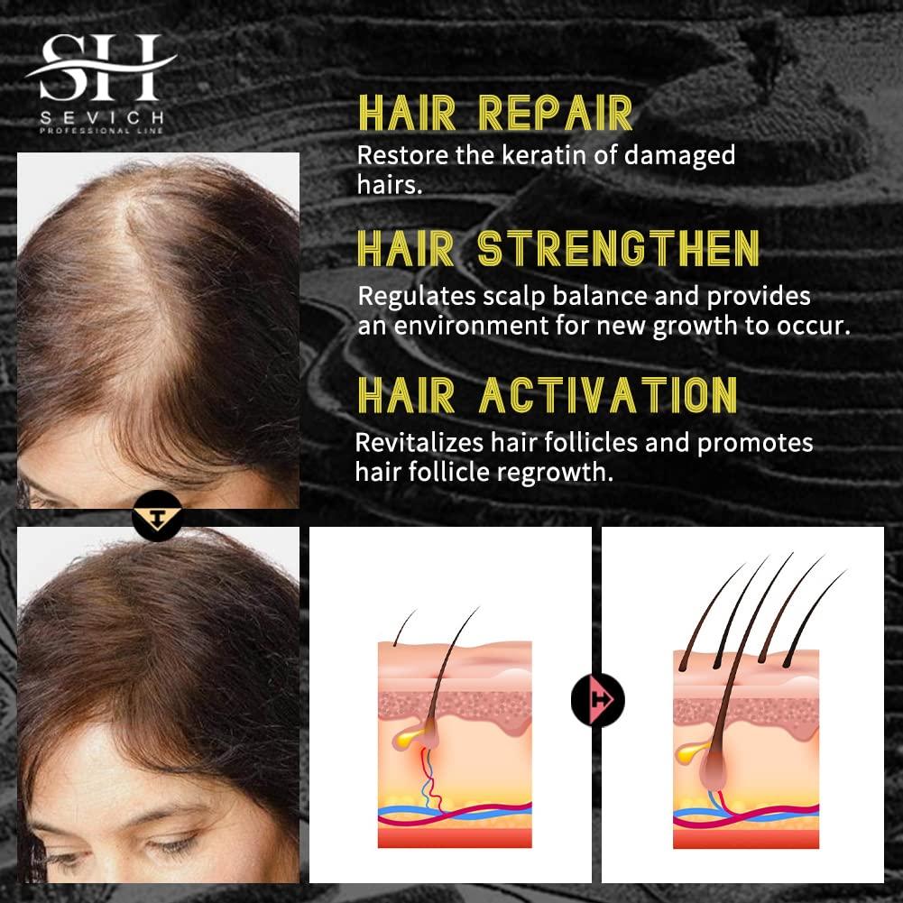 Damaged Hair Follicles