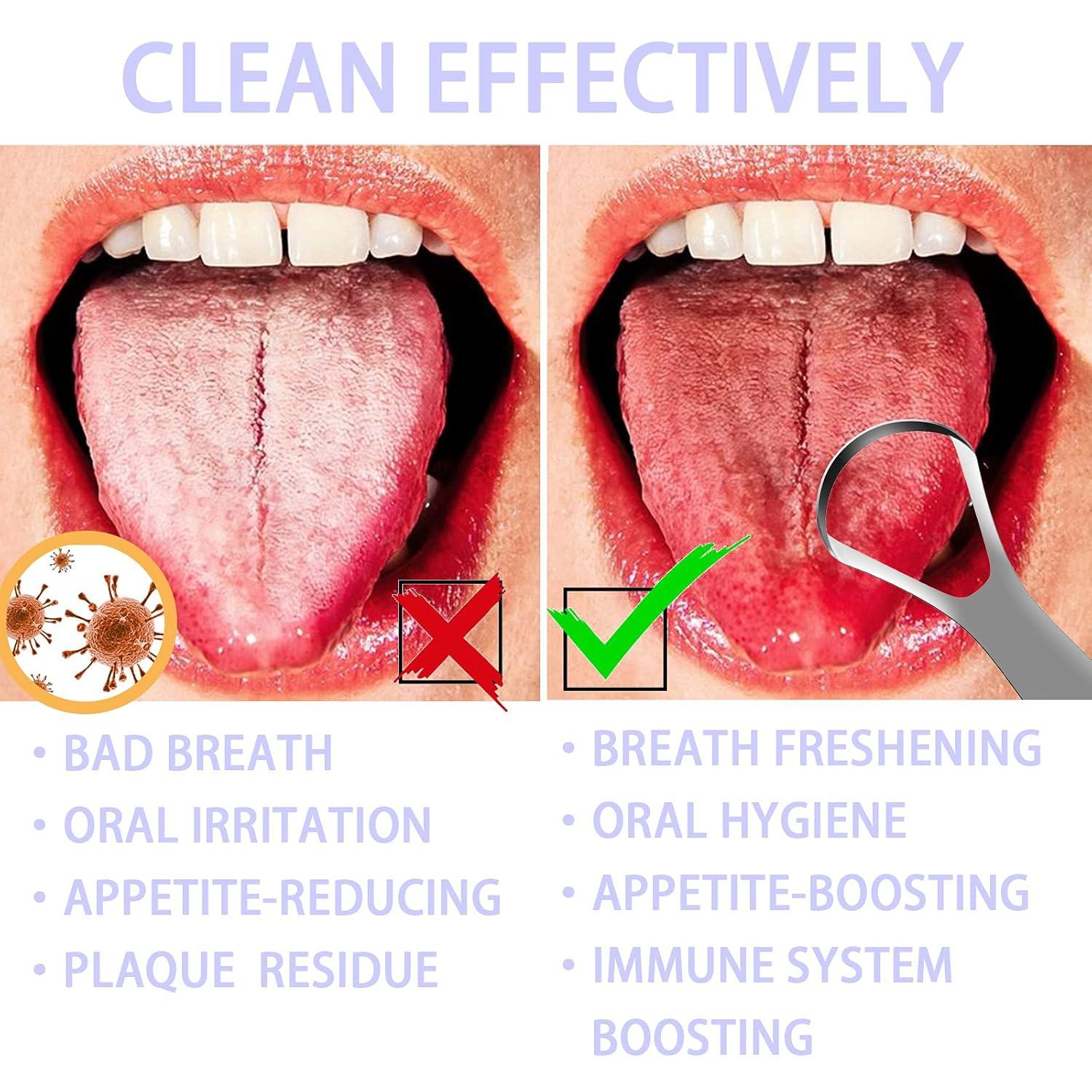 Doopoo Stainless Steel Tongue Cleaner for Adults & Kids | Reduces Bad ...