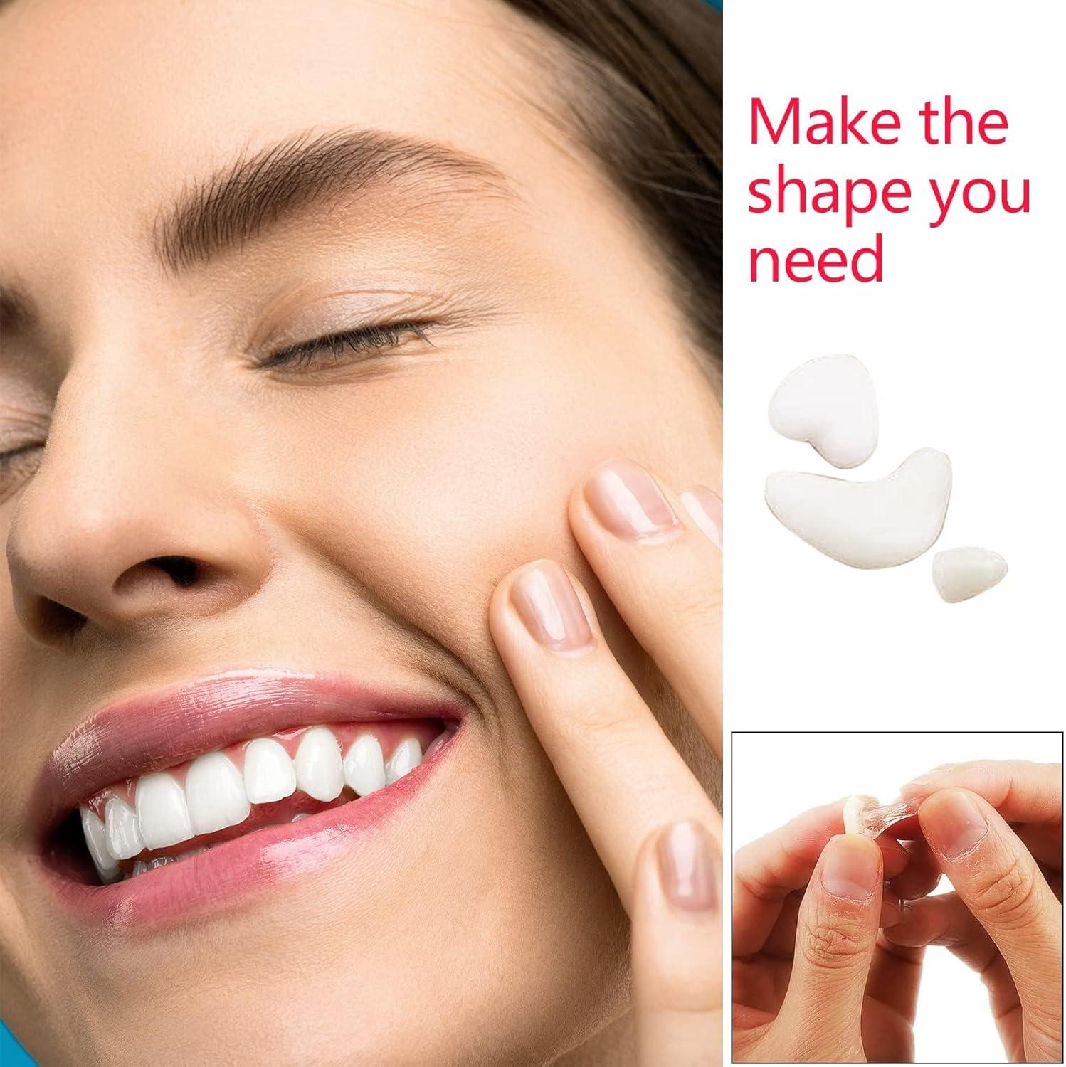 Teeth Repair Granules DIY Moldable False Teeth Temporary Tooth Filling ...