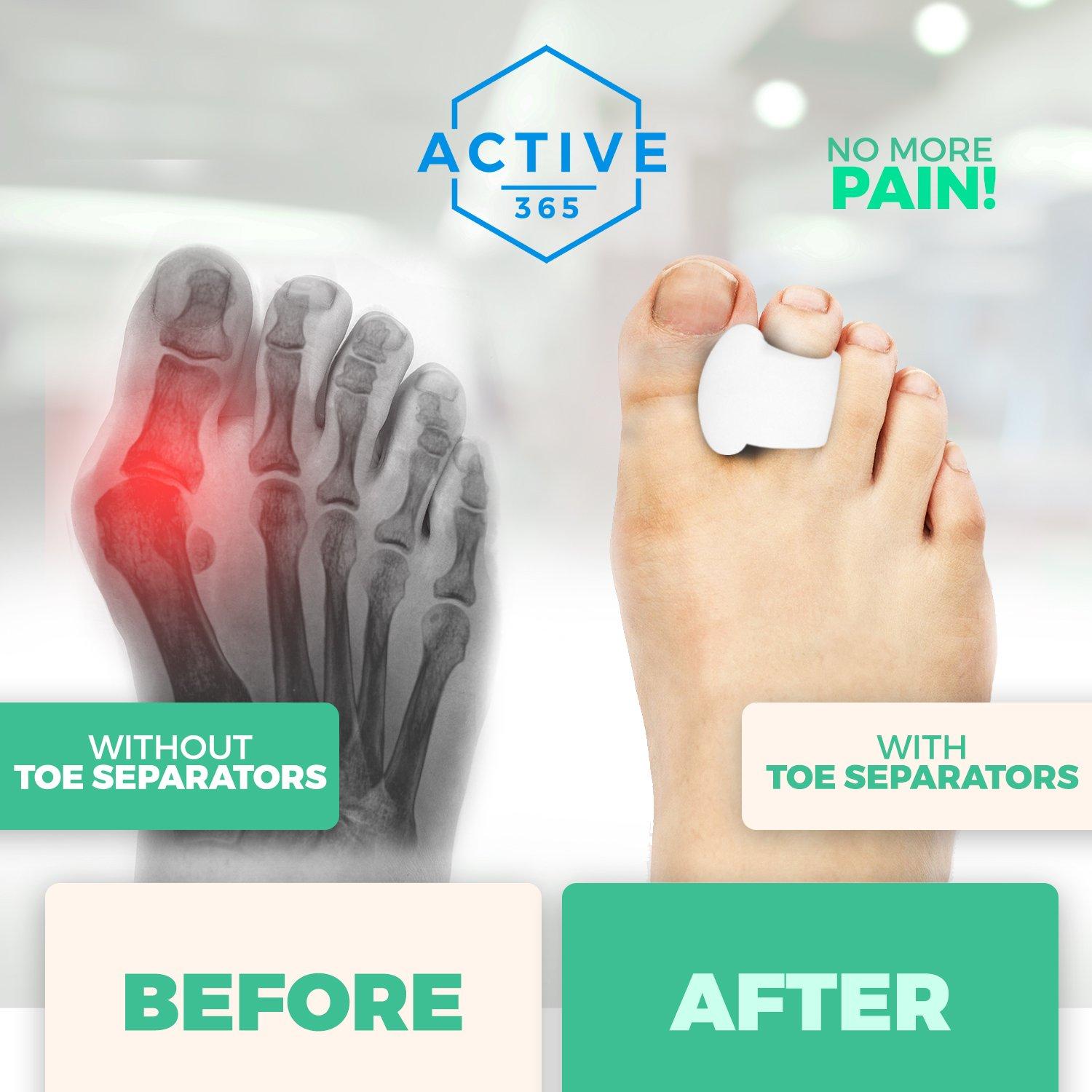 Active 365 Toe Separators for Bunions & Hammer Toes | Gel Toe Spacers ...