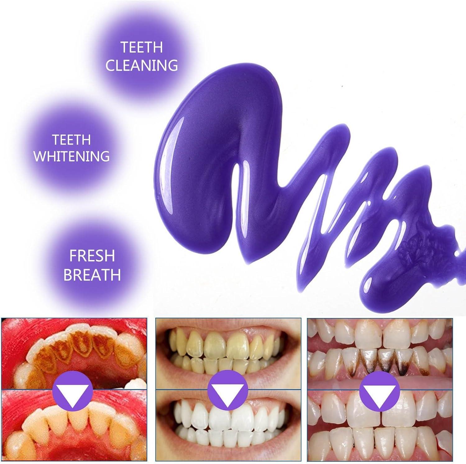 Purple Toothpaste for Teeth Whitening & Color Correction - Remove ...