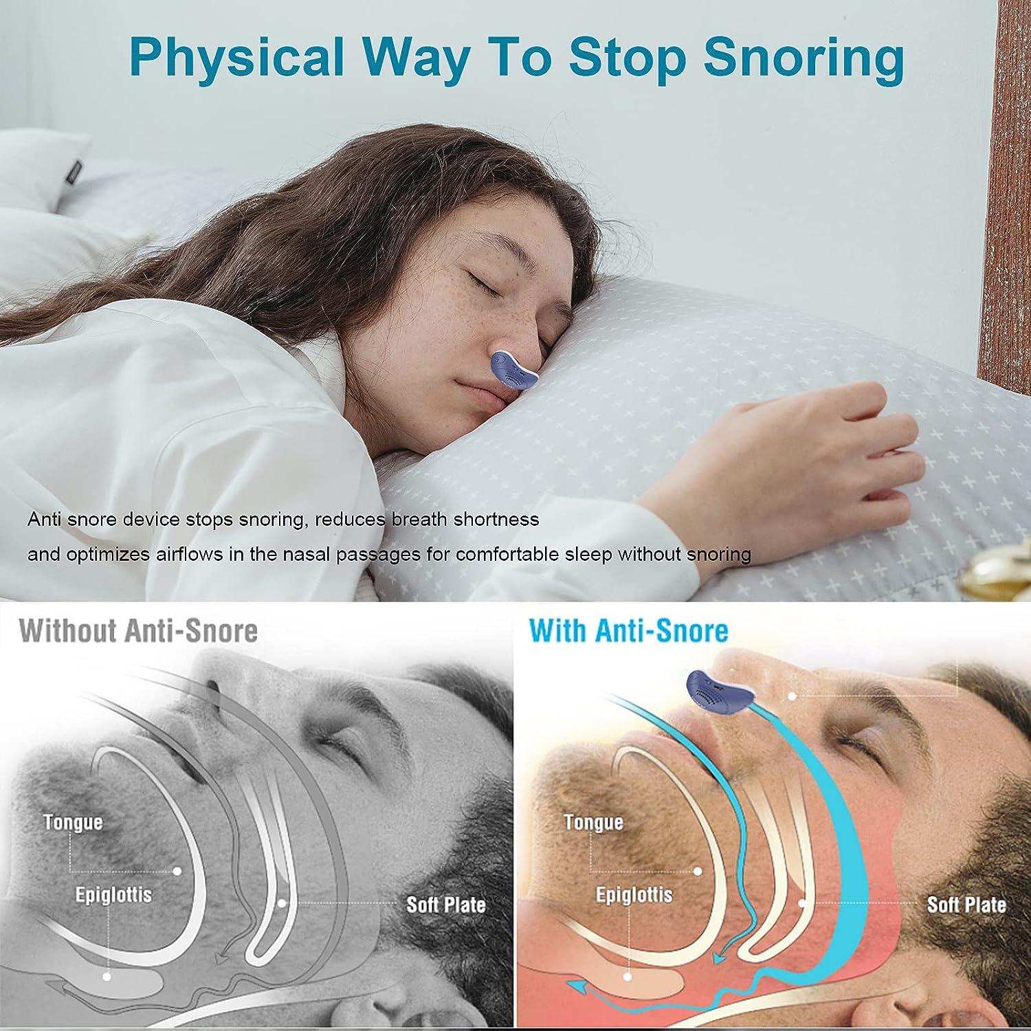 Portable Electric Anti Snoring Device | Sleep Solutions for Men and ...