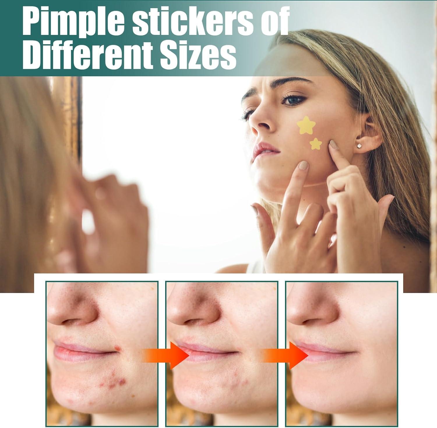 224 Star Shape Pimple Acne Hydrocolloid Patches - Absorbing Cover for ...