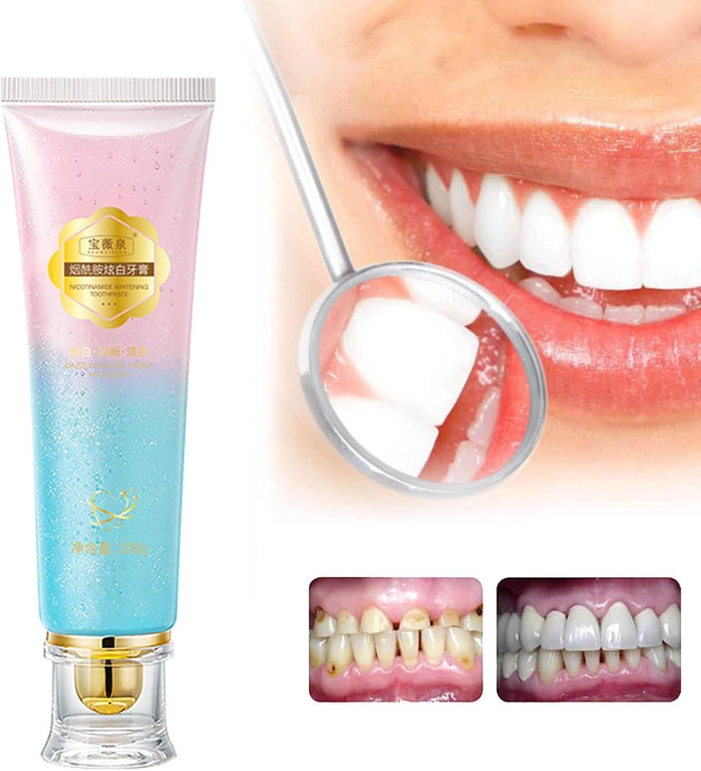 Nicotinamide Dazzle White Toothpaste - Probiotic Stain Removal ...