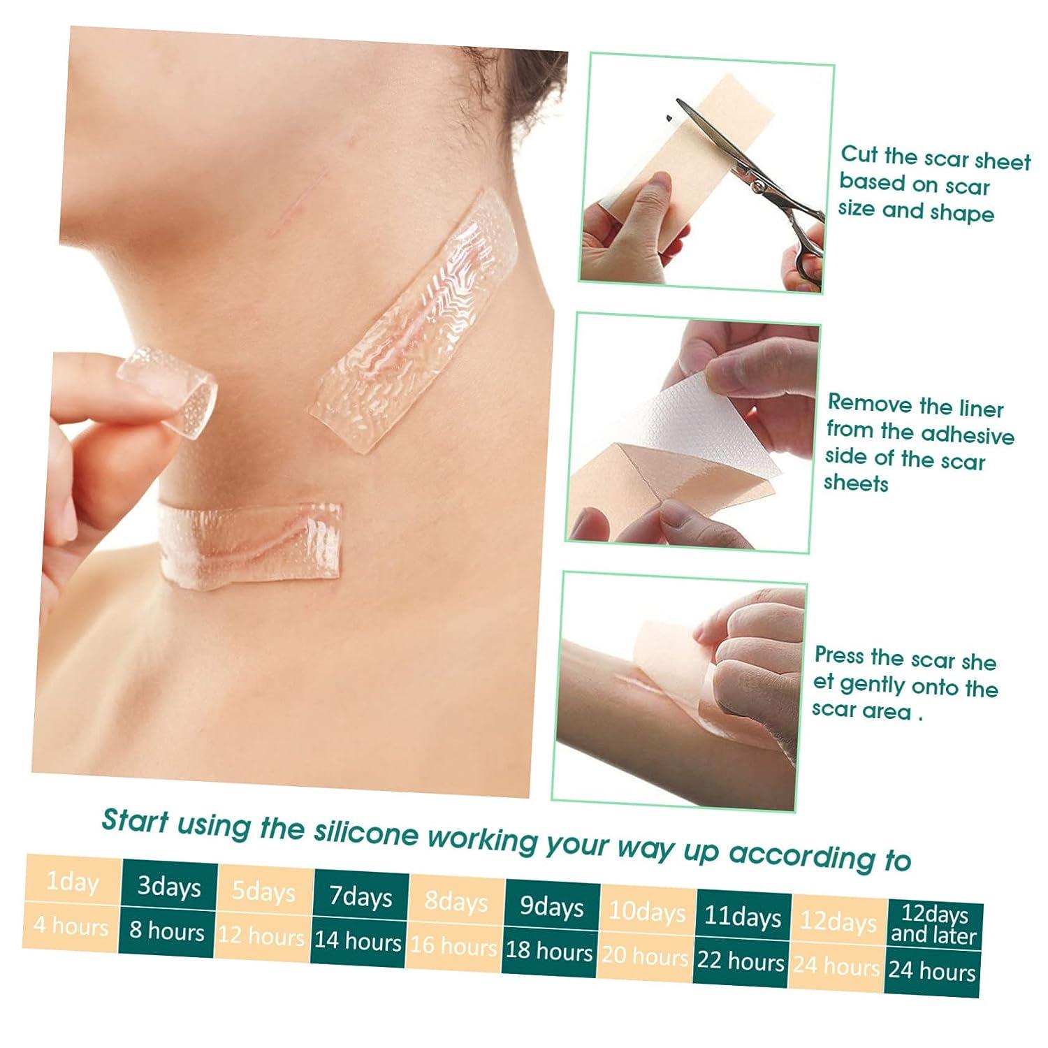 4pcs FOMIYES Silicone Scar Strips for Surgery Scars - Silicone Scar ...