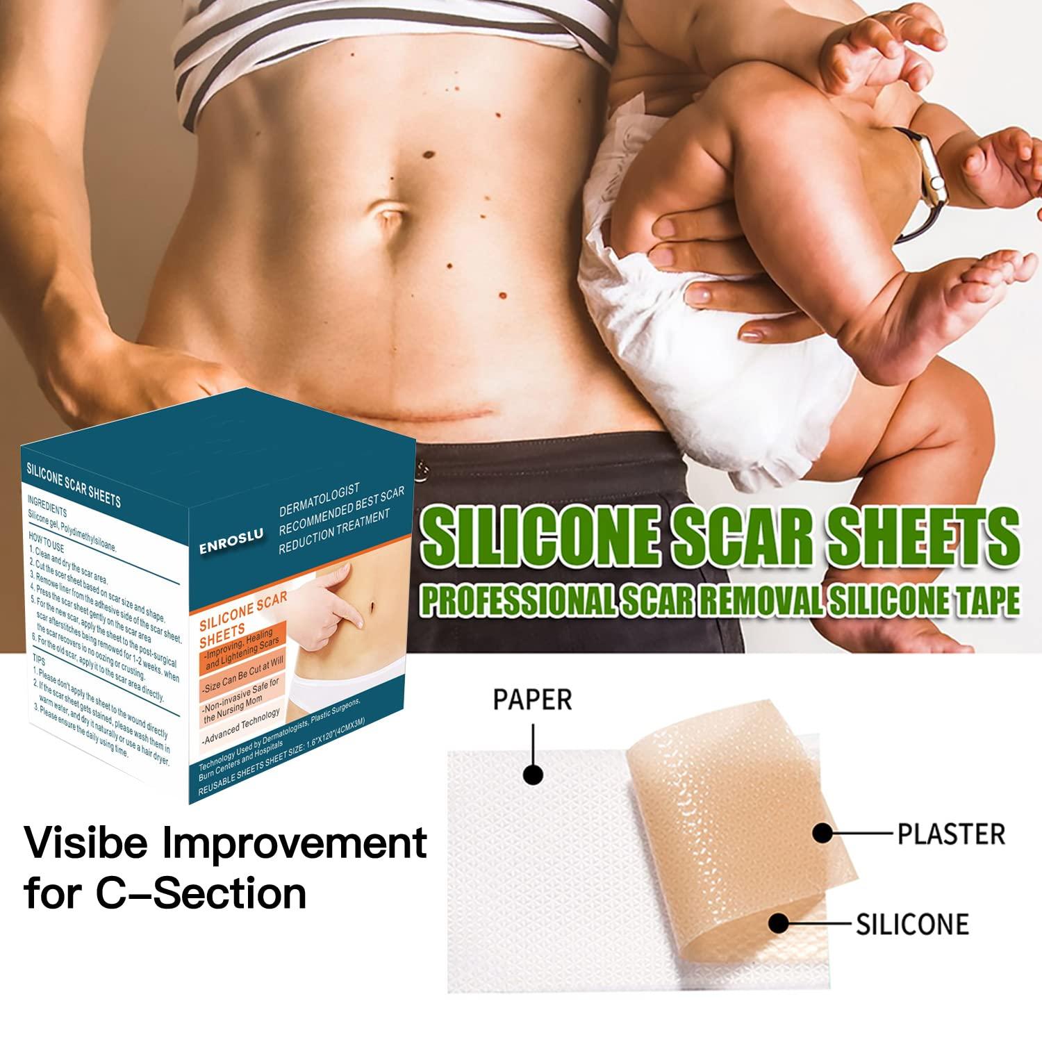 silicone sheet c section