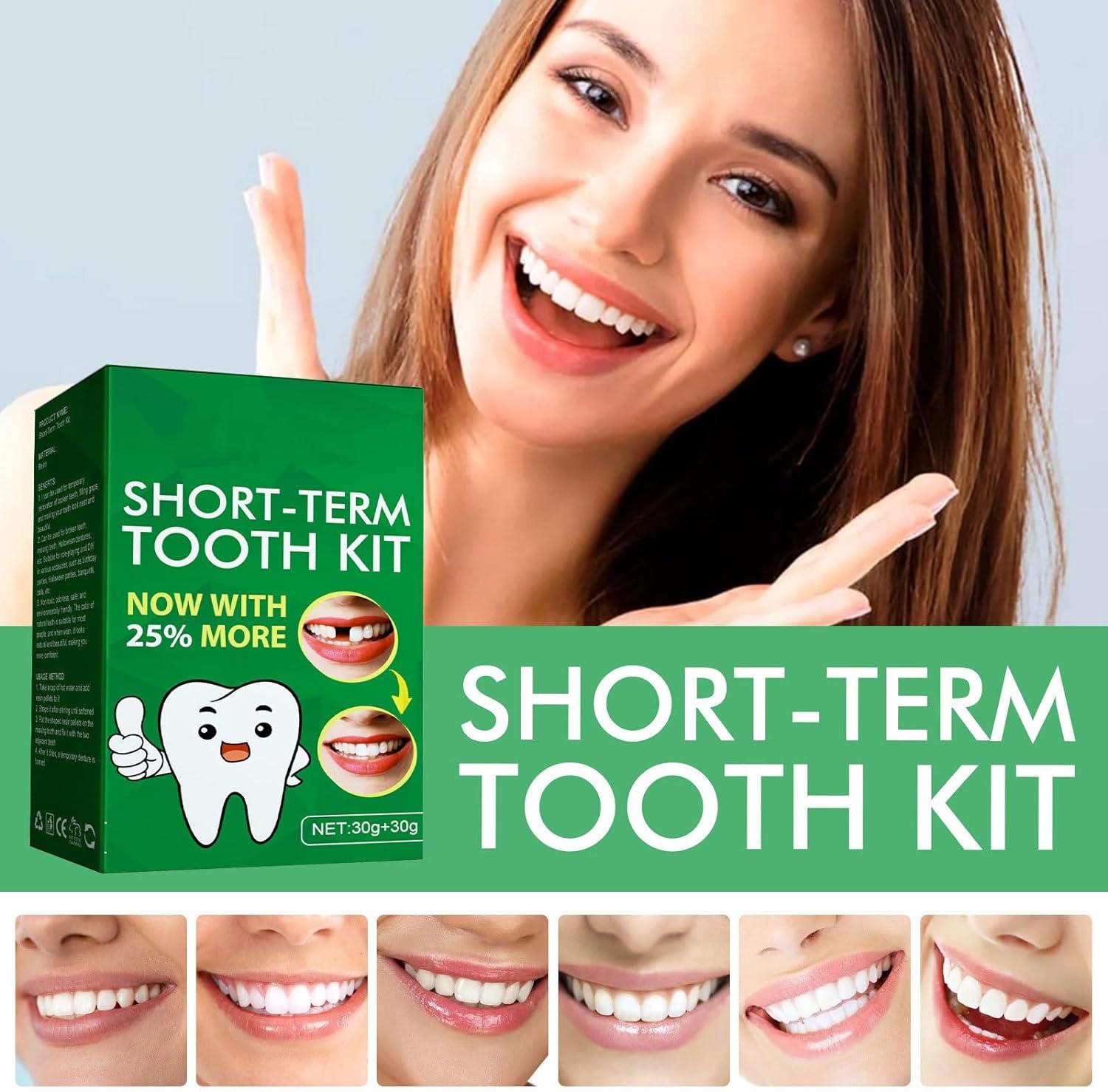 Ceonam Tooth Repair Set - 60g Temporary Artificial Teeth Replacement ...