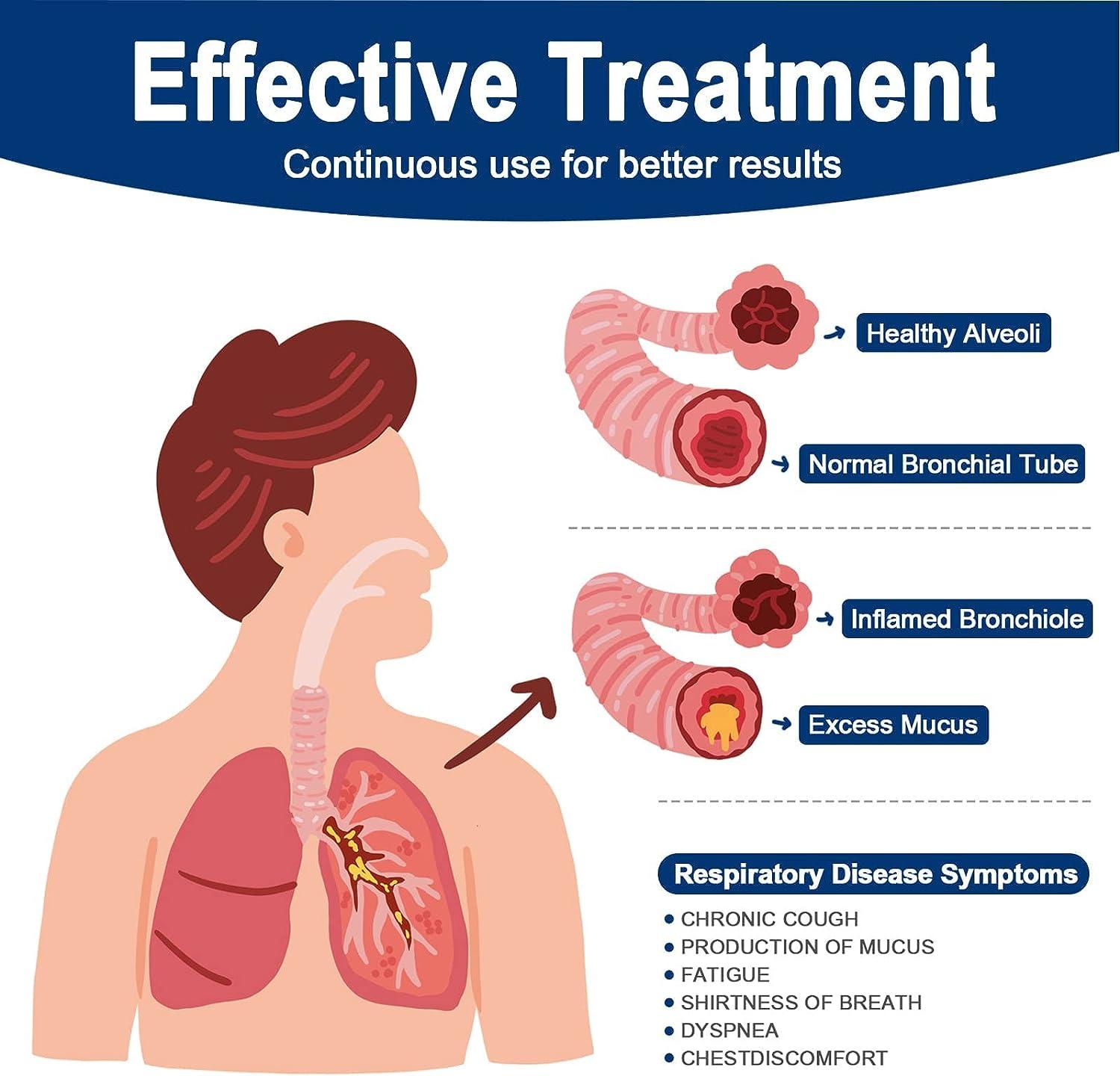 Lung Exerciser Device for Stronger Lungs | OPEP Therapy for Mucus Relief & Lung Expansion | Buy ...