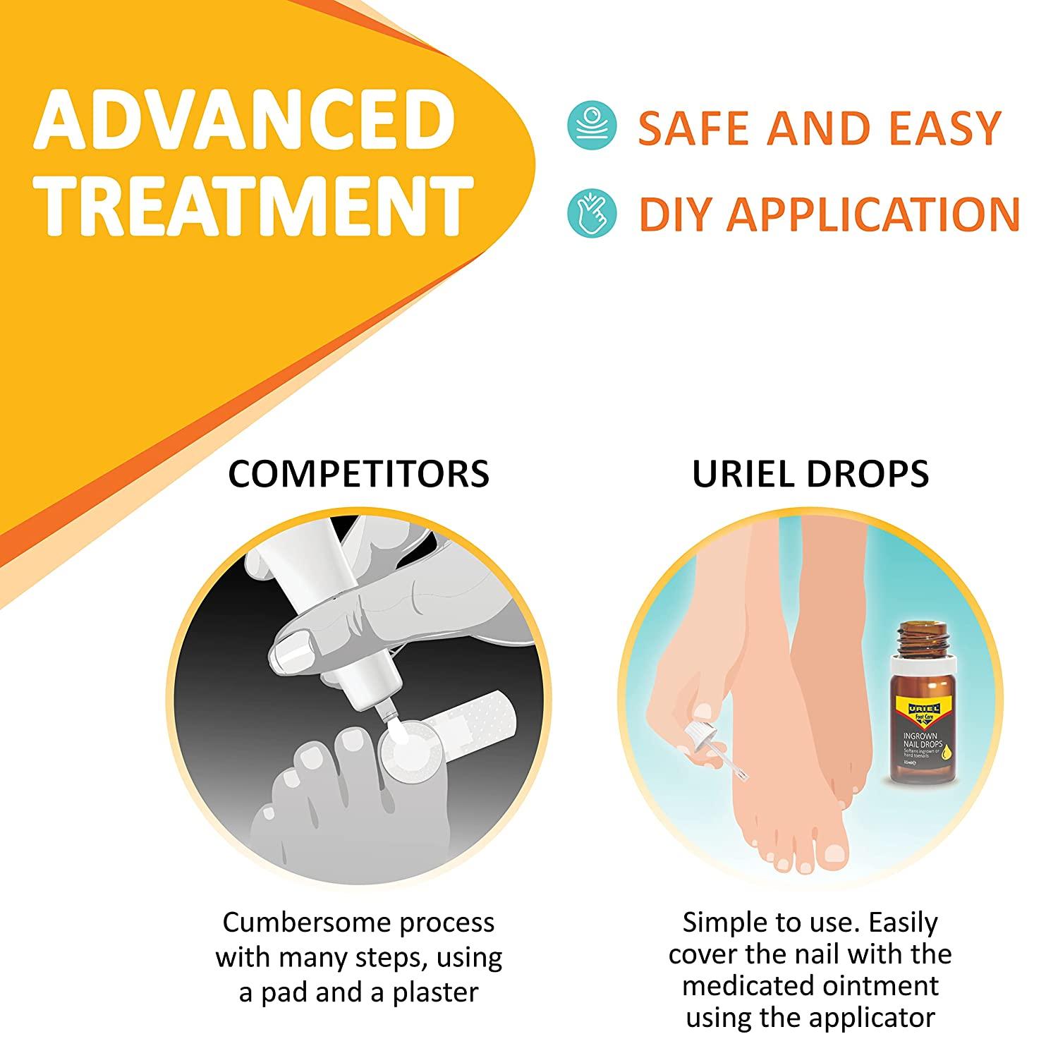 URIEL Advanced Treatment Ingrown Toenail Drops - Effective Solution for ...