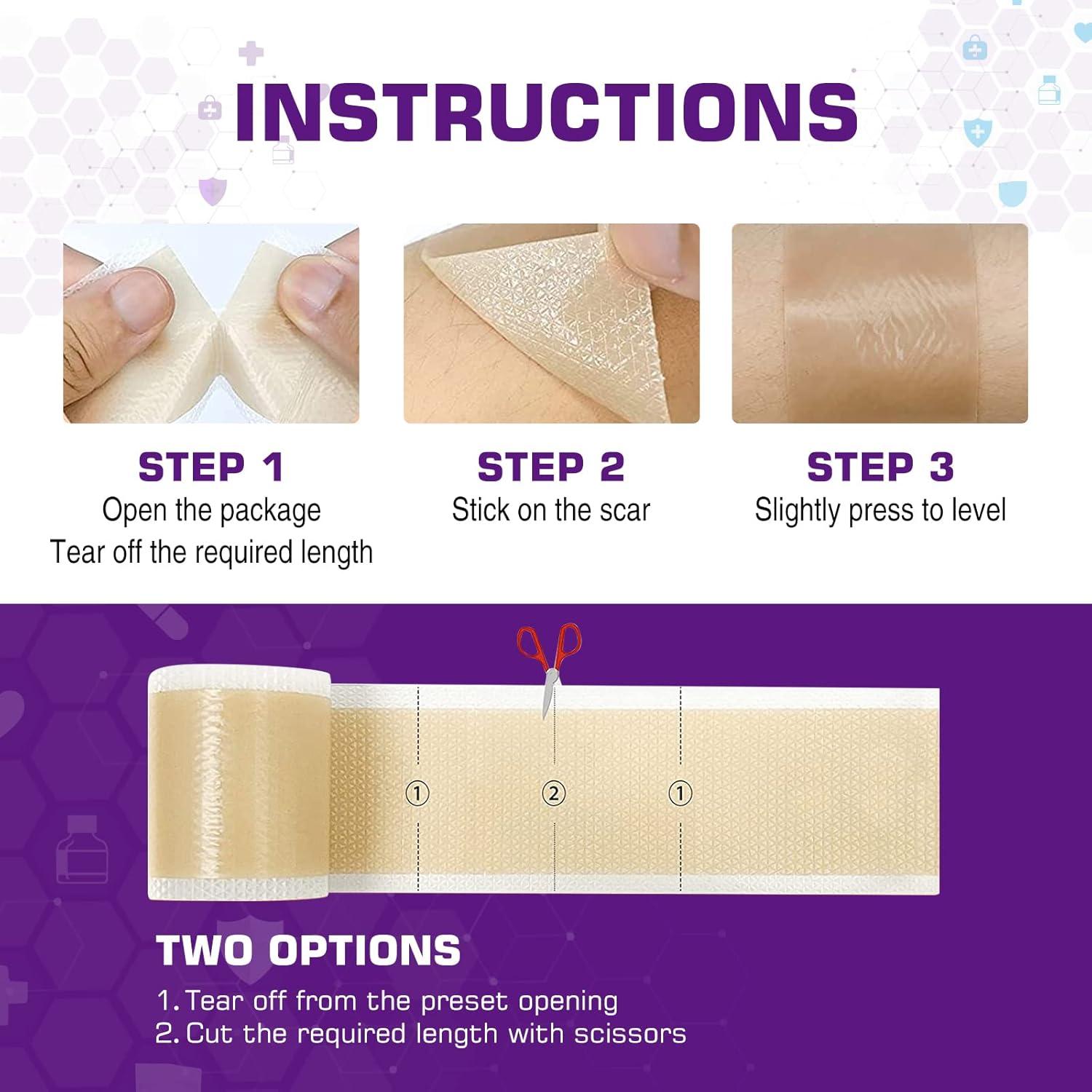 Silicone Scar Removal Sheets - Reusable Silicone Rag Band (4.1 cm x 152 ...