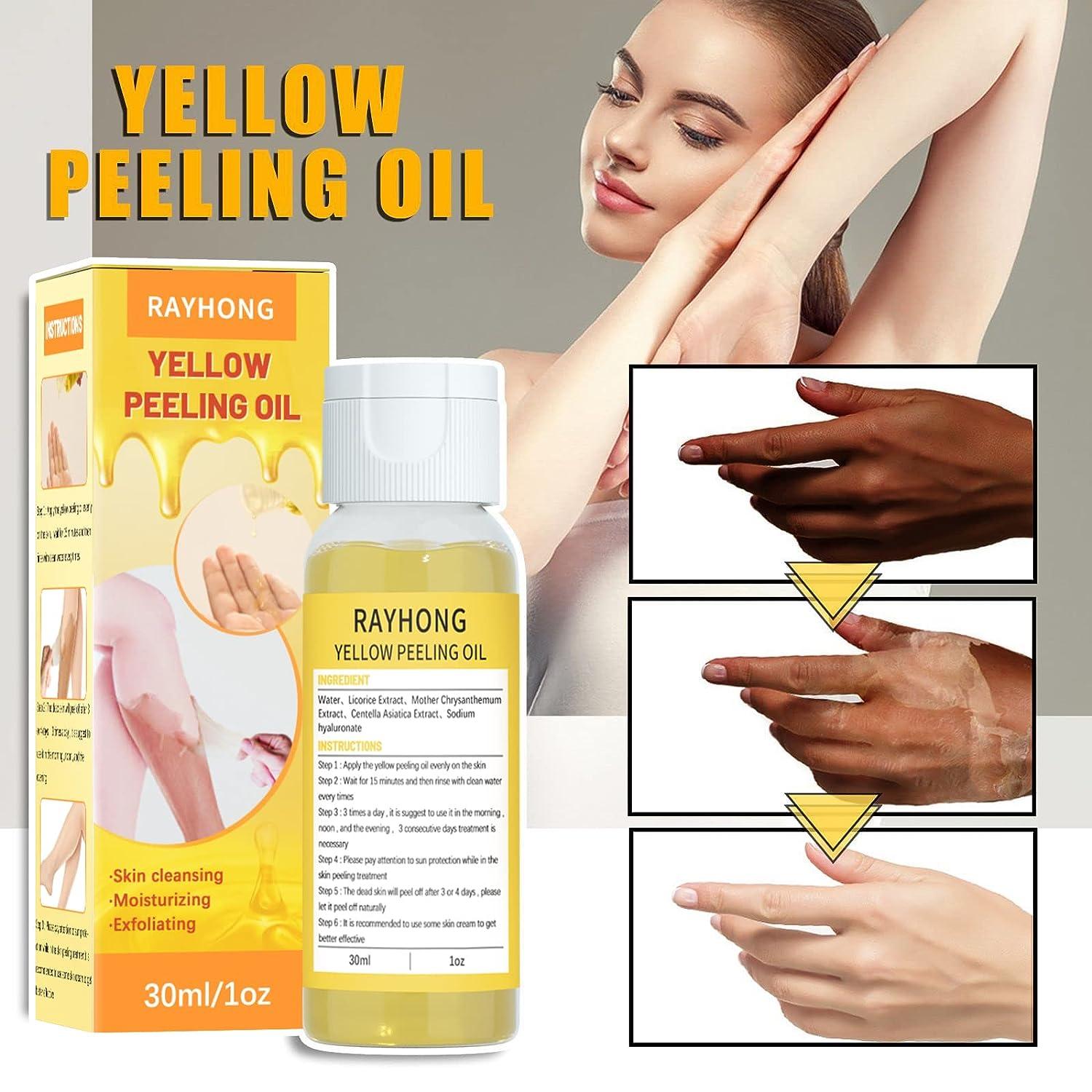 Extra Strength Yellow Peeling Oil 30ML - Lighten Dark Spots, Brighten ...