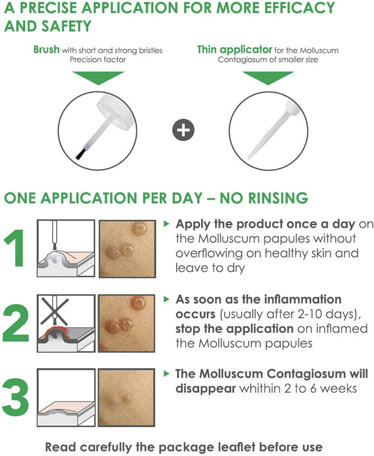 Molutrex Molluscum Contagiosum Treatment 3ml - Fast & Effective Relief ...