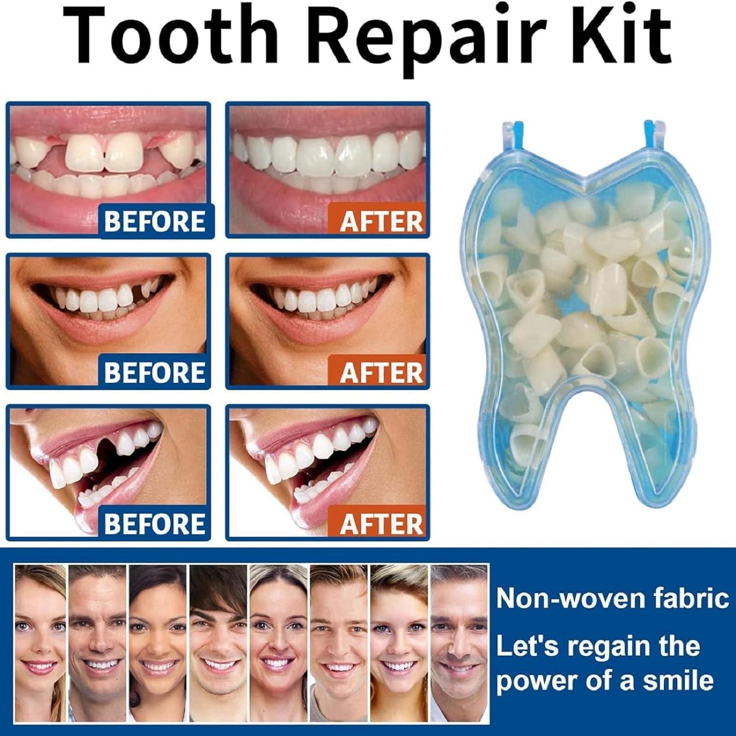 50PCS Temporary Tooth Crown Kit for Front Teeth - Denture Repair ...