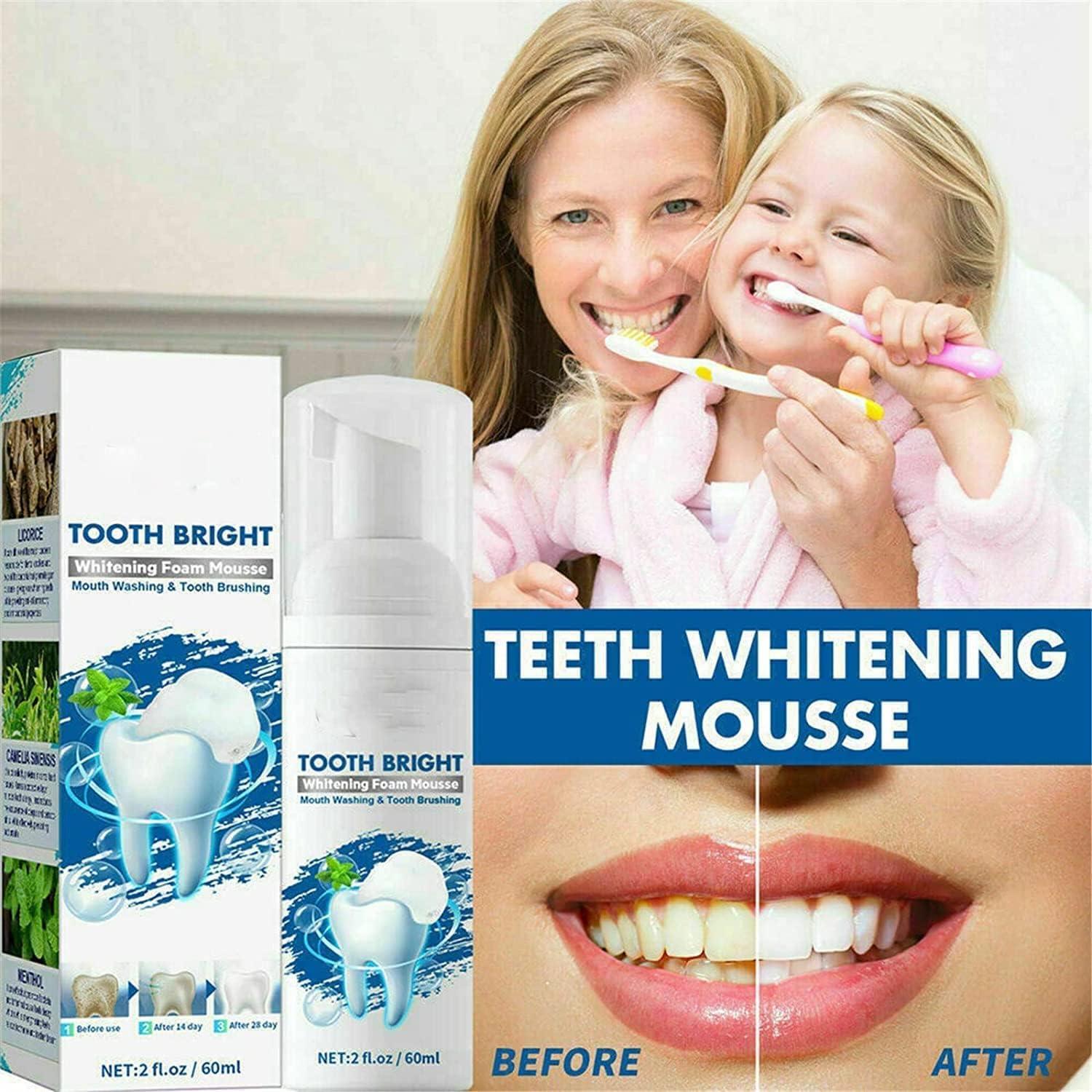 Teeth Whitening Mousse - Ultra Cleansing Foam Toothpaste for Intensive ...