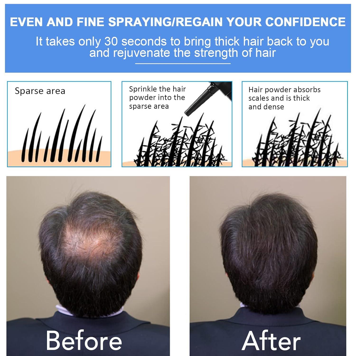 Aliver Hair Fiber Applicator Pump Spray Nozzle | Optimize Hair Building ...