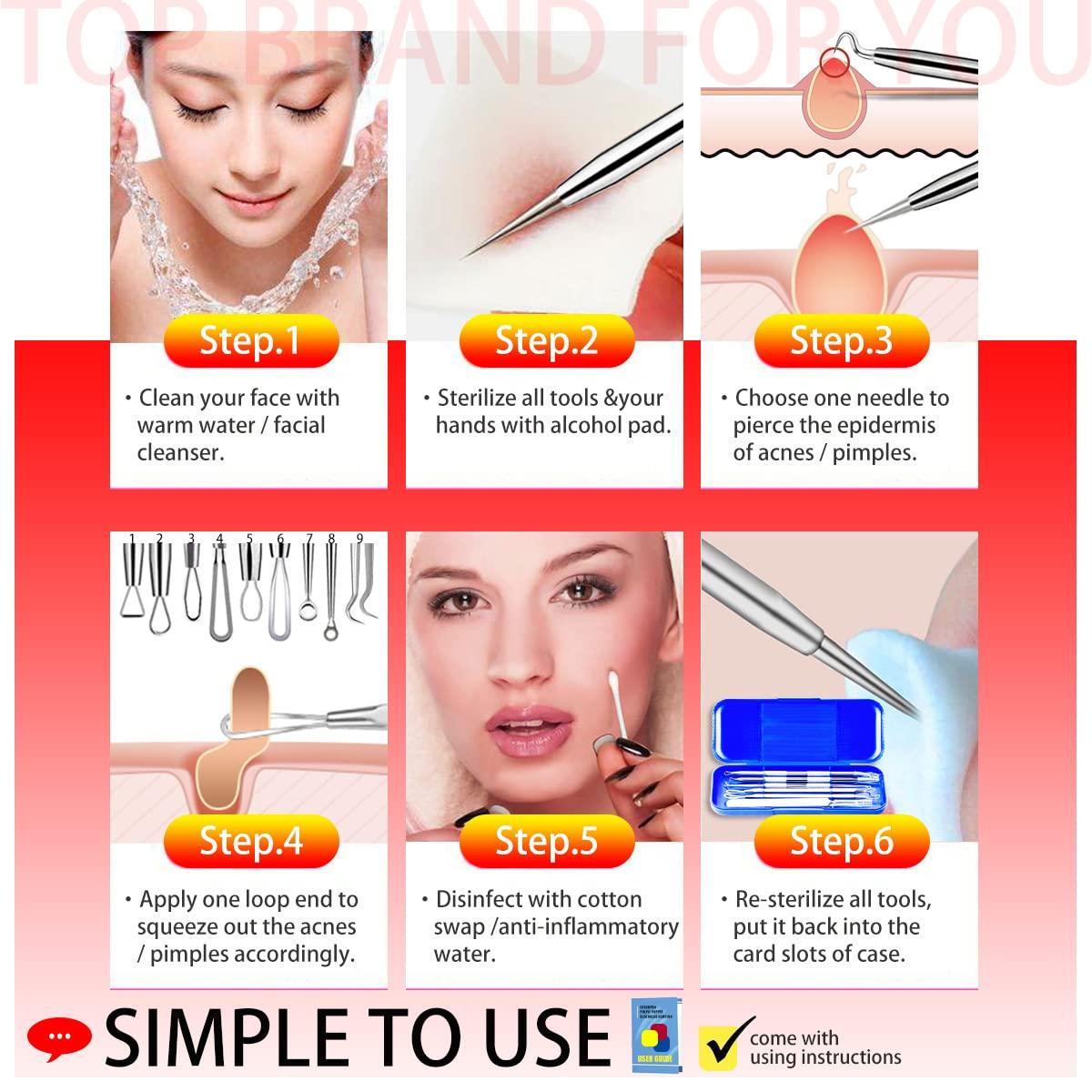 6-Piece Blackhead Remover Tool Kit with Case - Professional Acne ...